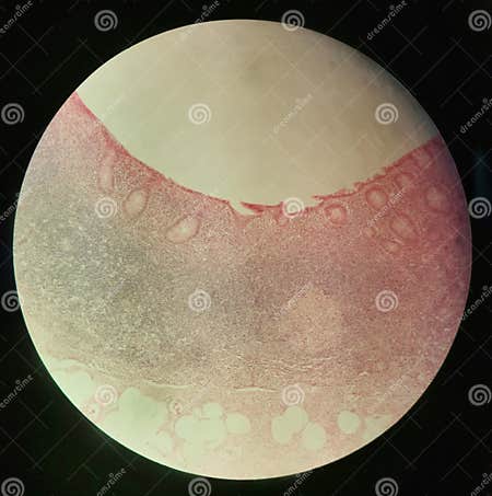 Cross Section through a Human Appendix Stock Photo - Image of body ...