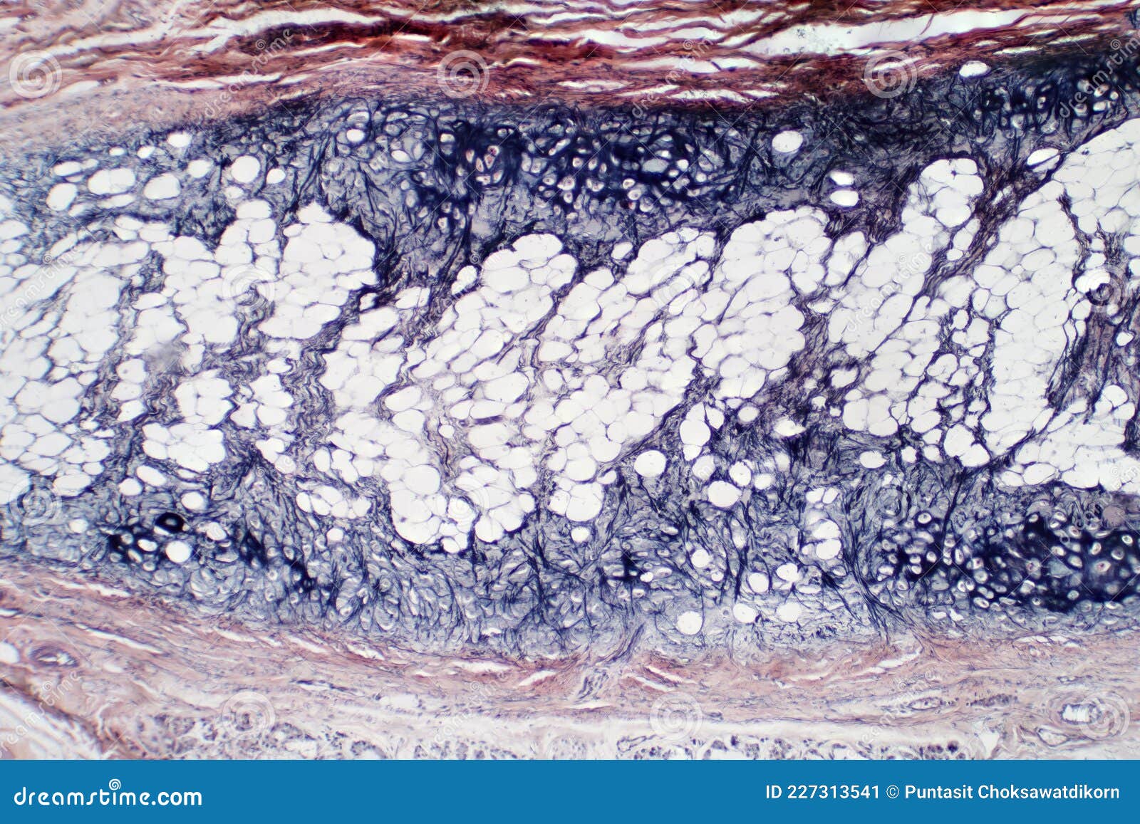 Cross Section Human Cartilage Bone Under Light Microscope View for ...