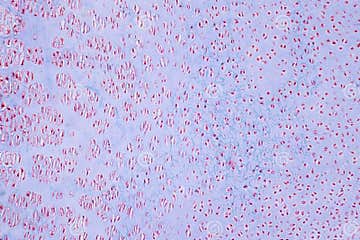 Cross Section Human Cartilage Bone Under Microscope View Stock Image ...
