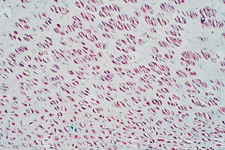 Cross Section Human Cartilage Bone Under Microscope View Stock ...