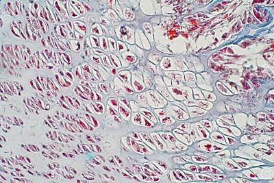 Cross Section Human Cartilage Bone Under Microscope View Stock Photo ...
