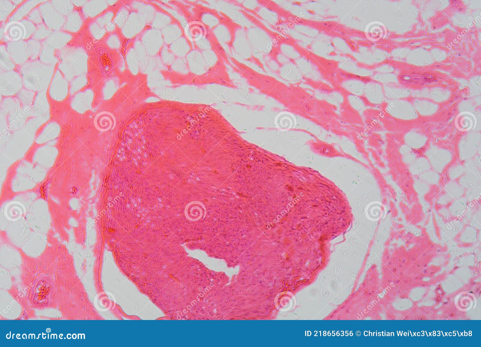 Cross Section of Human Nerve Cells Under the Microscope Stock Photo - Image of neurology ...