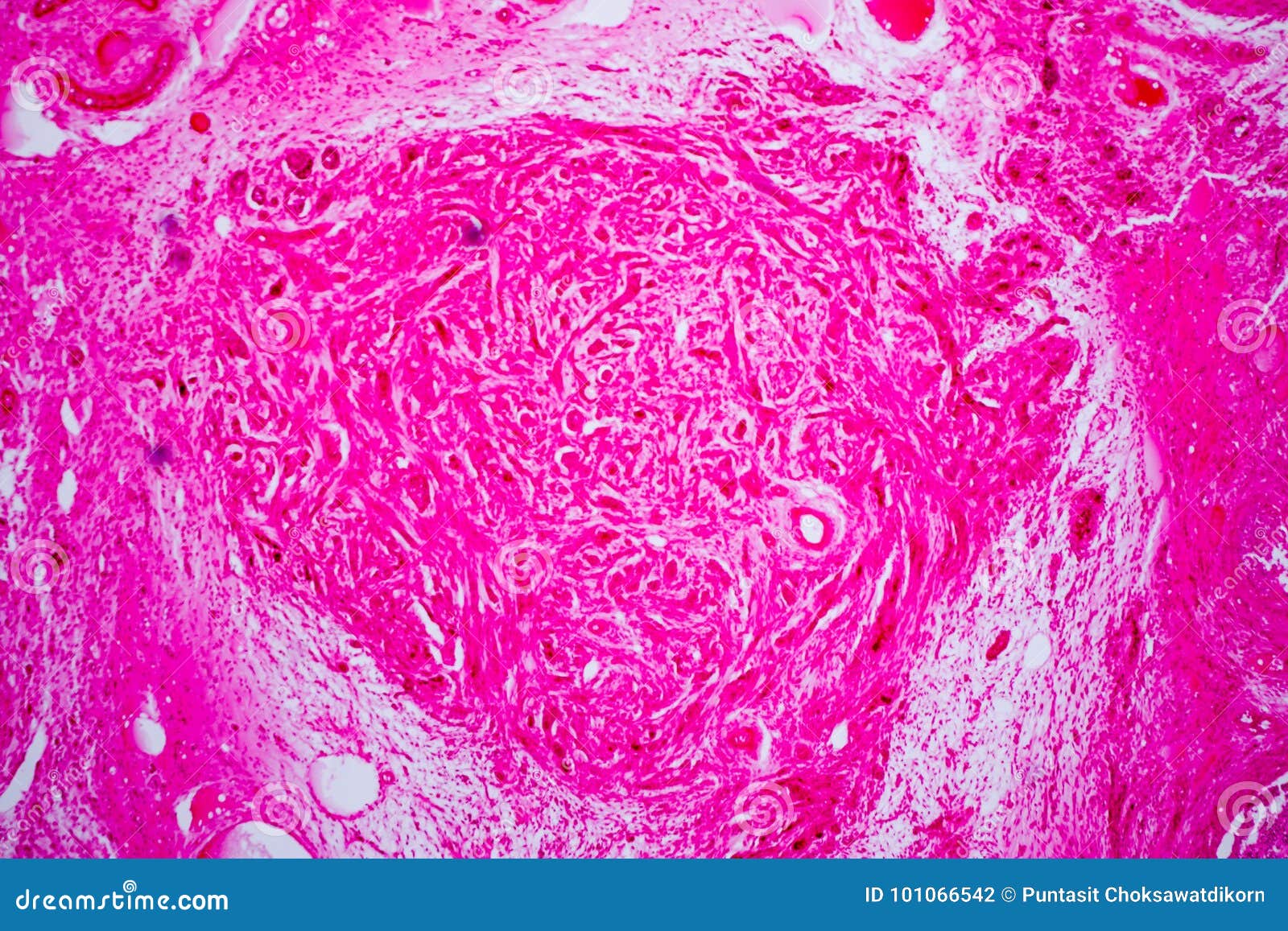Cross Section Human Ovary Under Microscope View. Stock Illustration ...