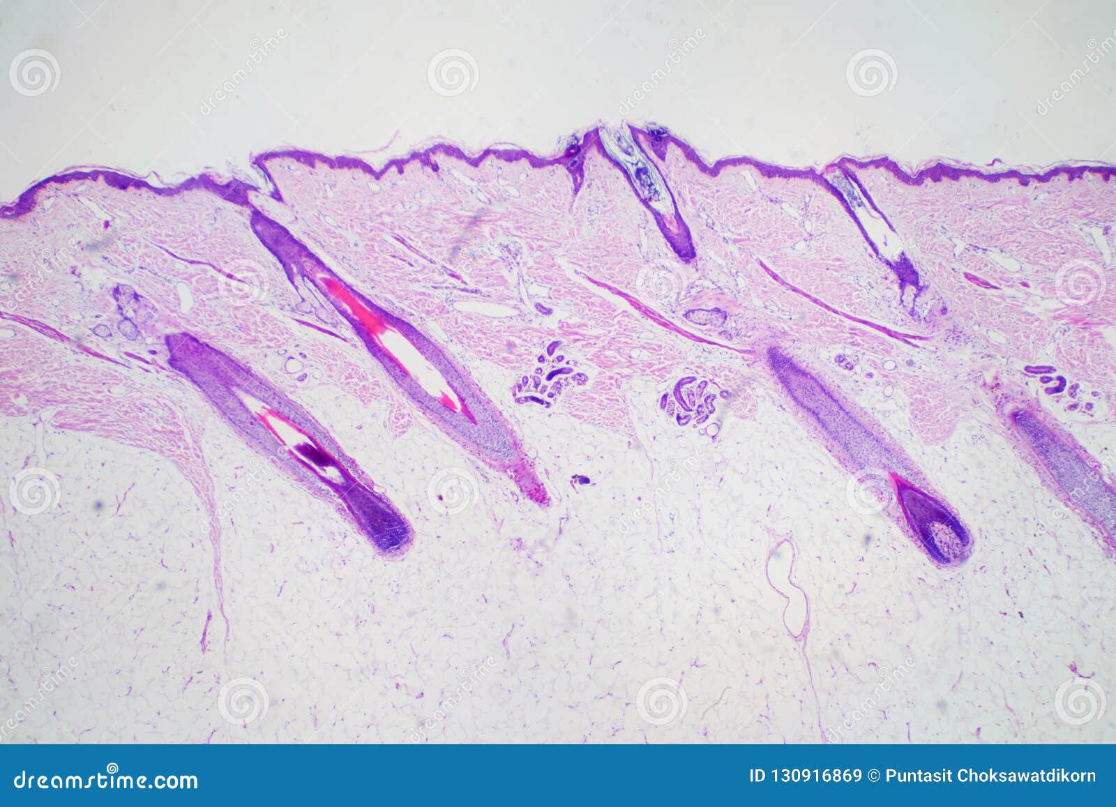Cross Section Human Skin Head Under Microscope View for Education ... Cross Section Human Skin Head Under Microscope View for Education ...