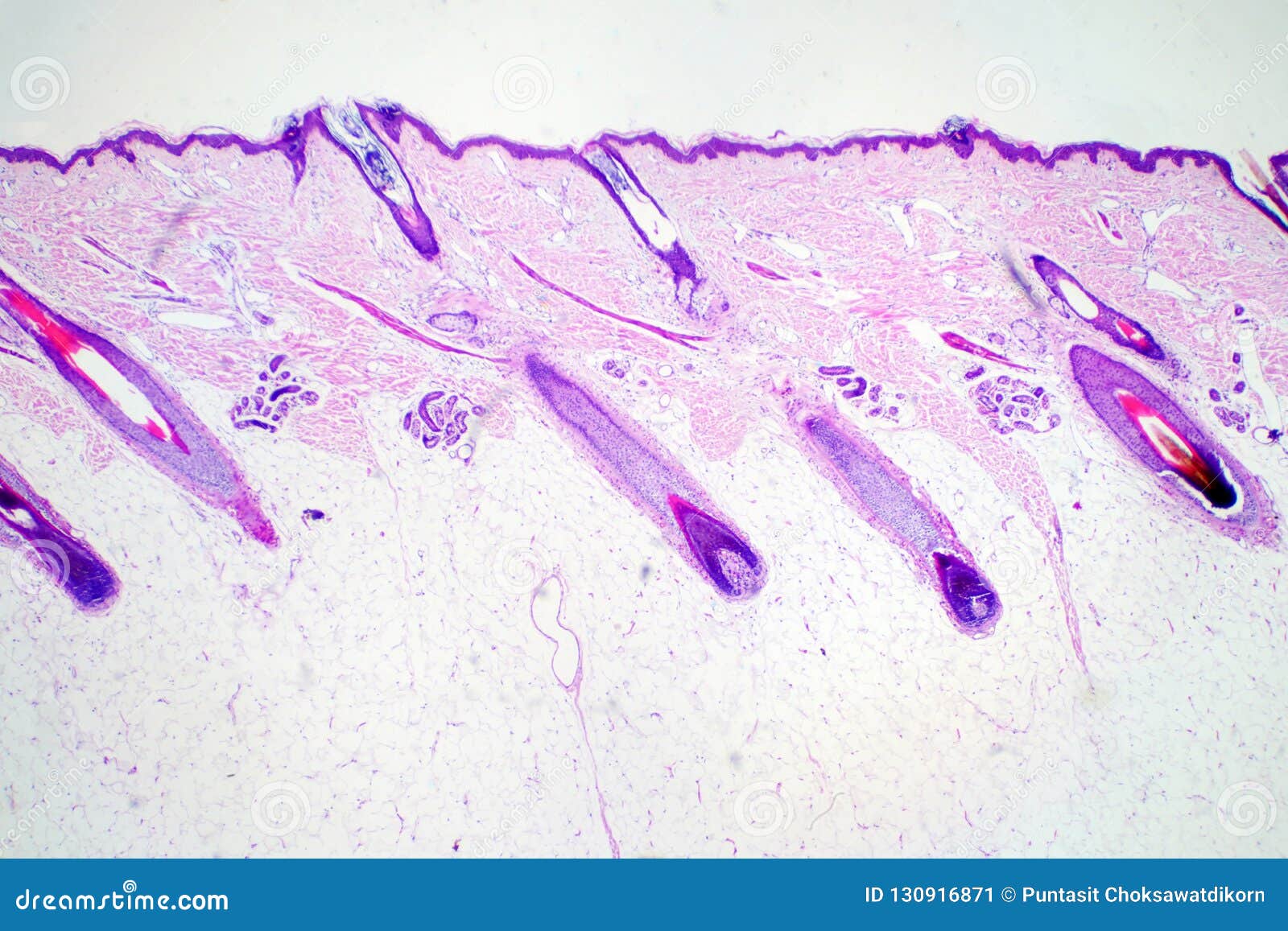Cross Section Human Skin Head Under Microscope View for Education ... Cross Section Human Skin Head Under Microscope View for Education ...