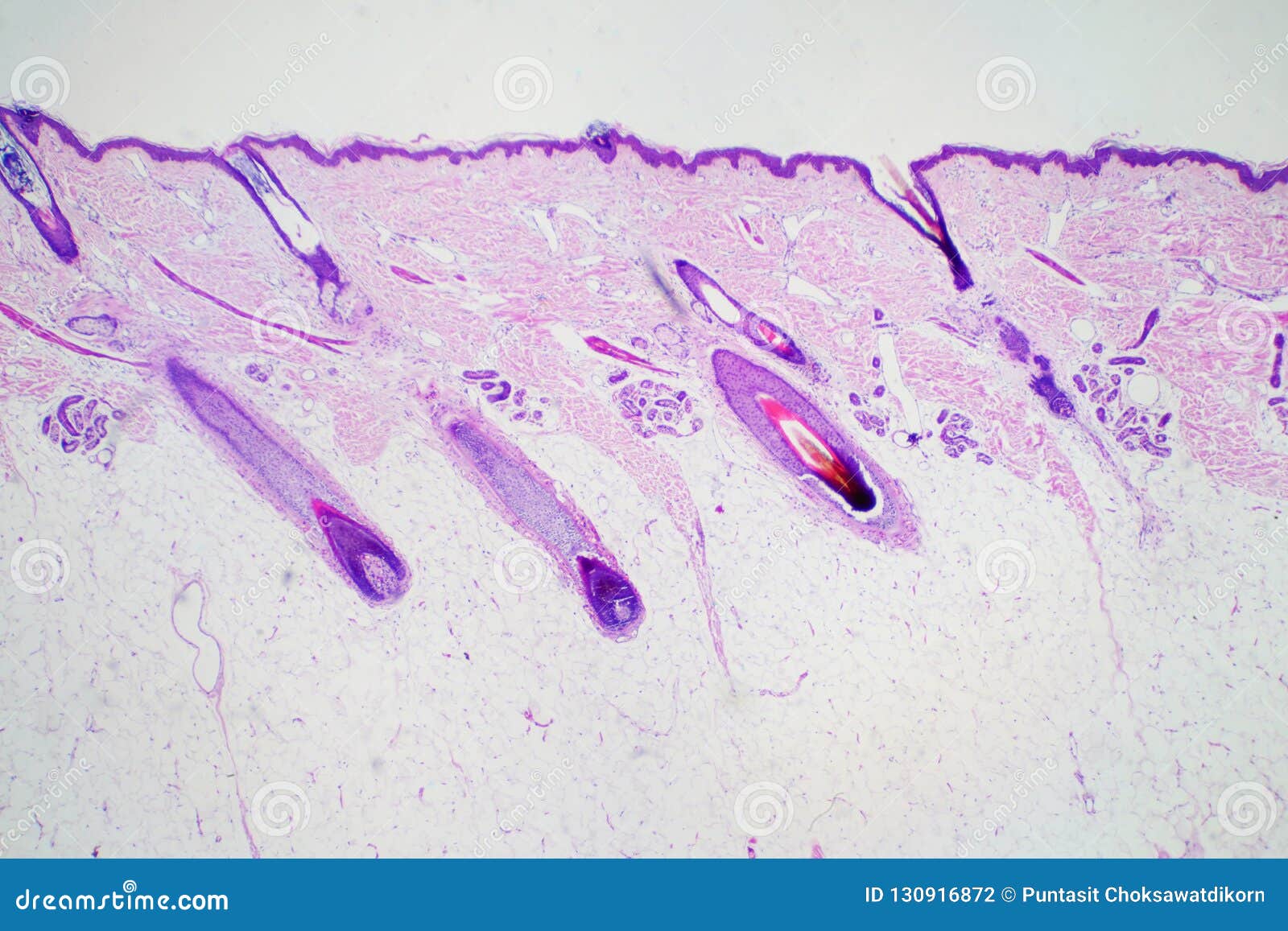 Cross Section Human Skin Head Under Microscope View for Education ... Cross Section Human Skin Head Under Microscope View for Education ...