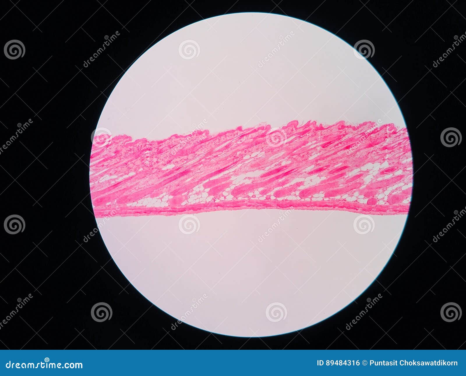 Cross Section Human Skin Tissue Royalty-Free Stock Image ...