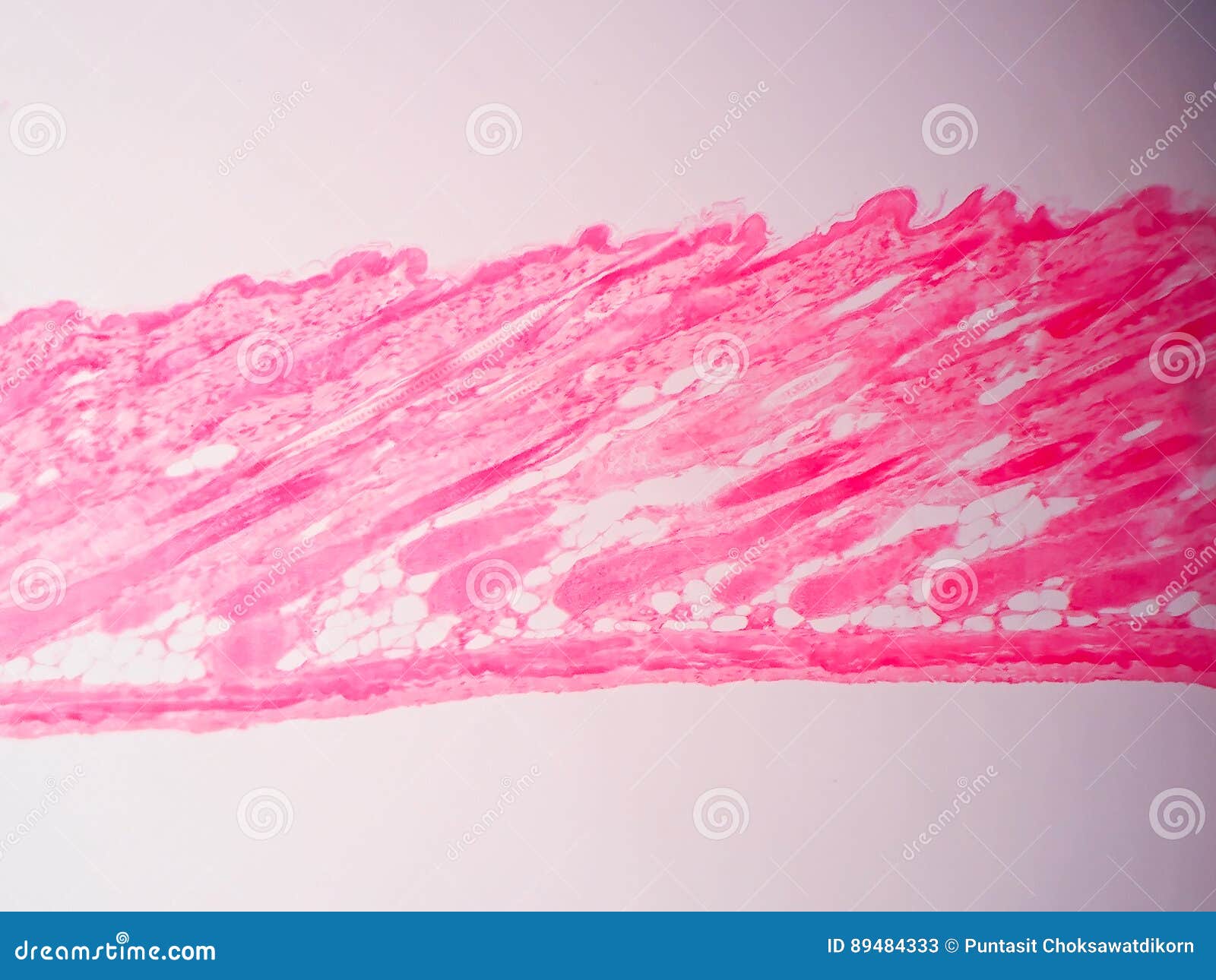 Cross section human skin stock illustration. Illustration of anatomical ...