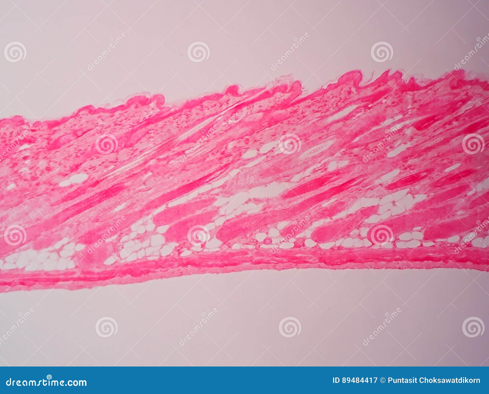 Cross Section Human Skin Tissue Stock Illustration - Illustration of ...