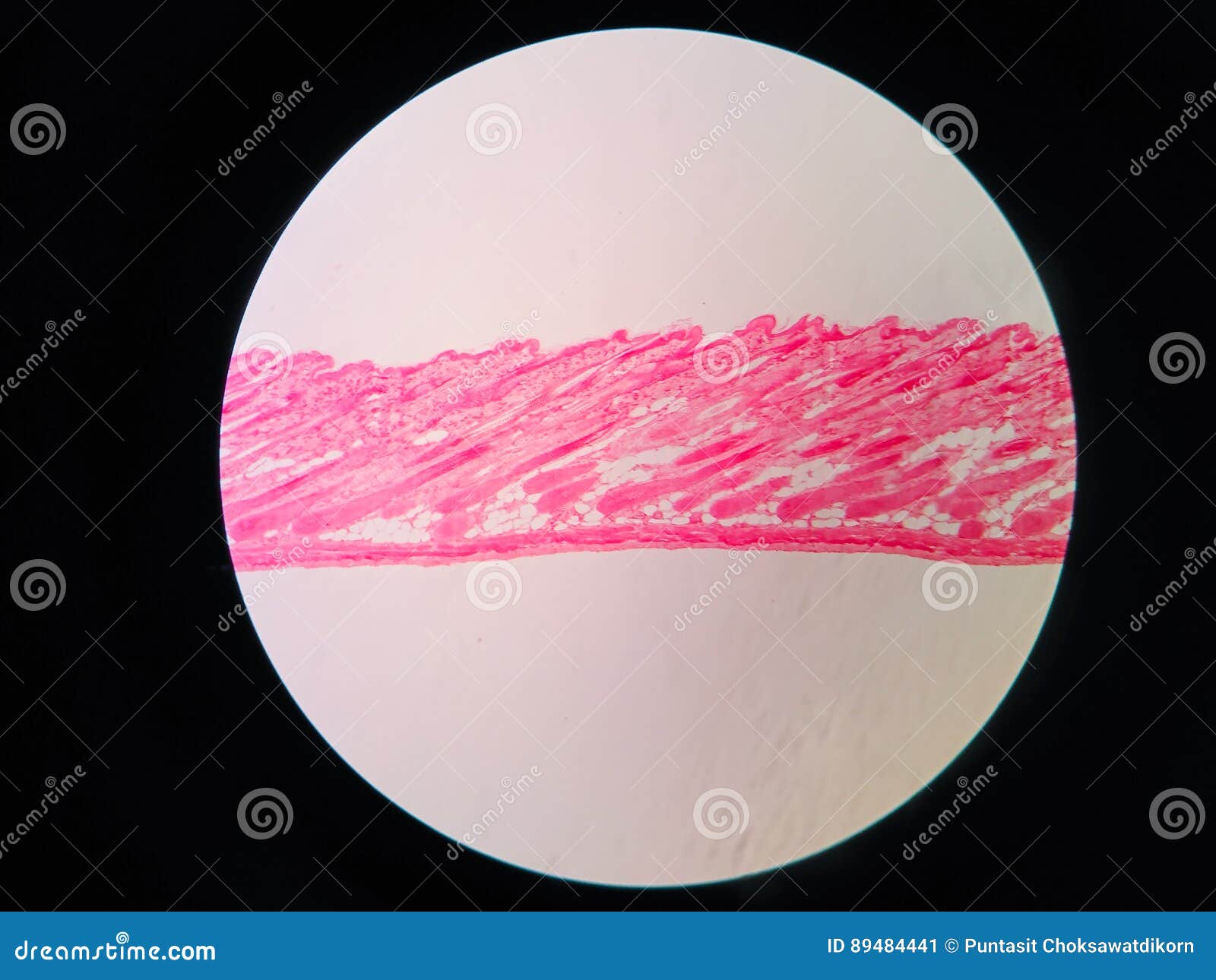 Cross Section Human Skin Tissue Stock Illustration - Illustration of ...