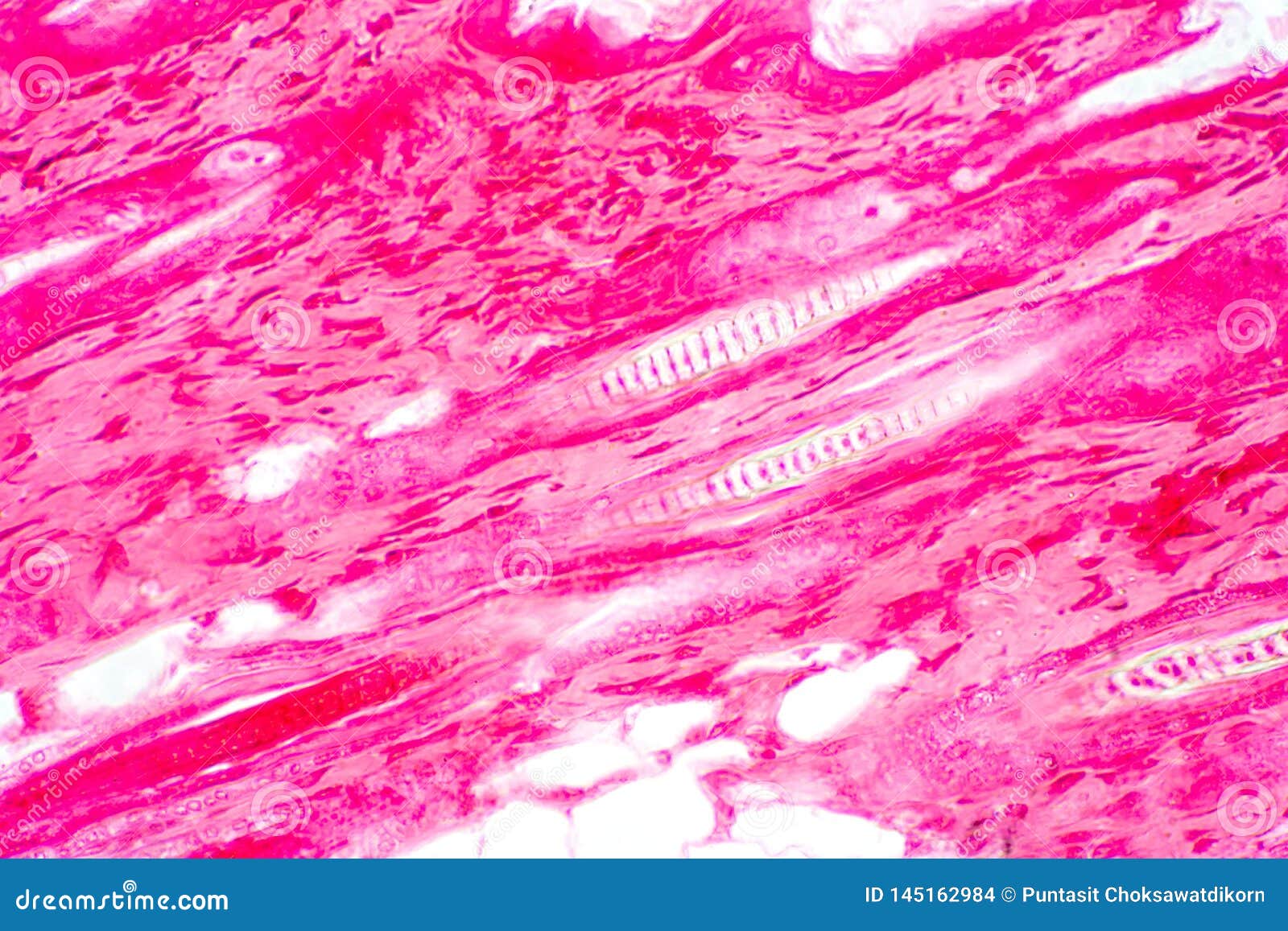 Cross Section Human Skin Tissue Under Microscope View Stock ...