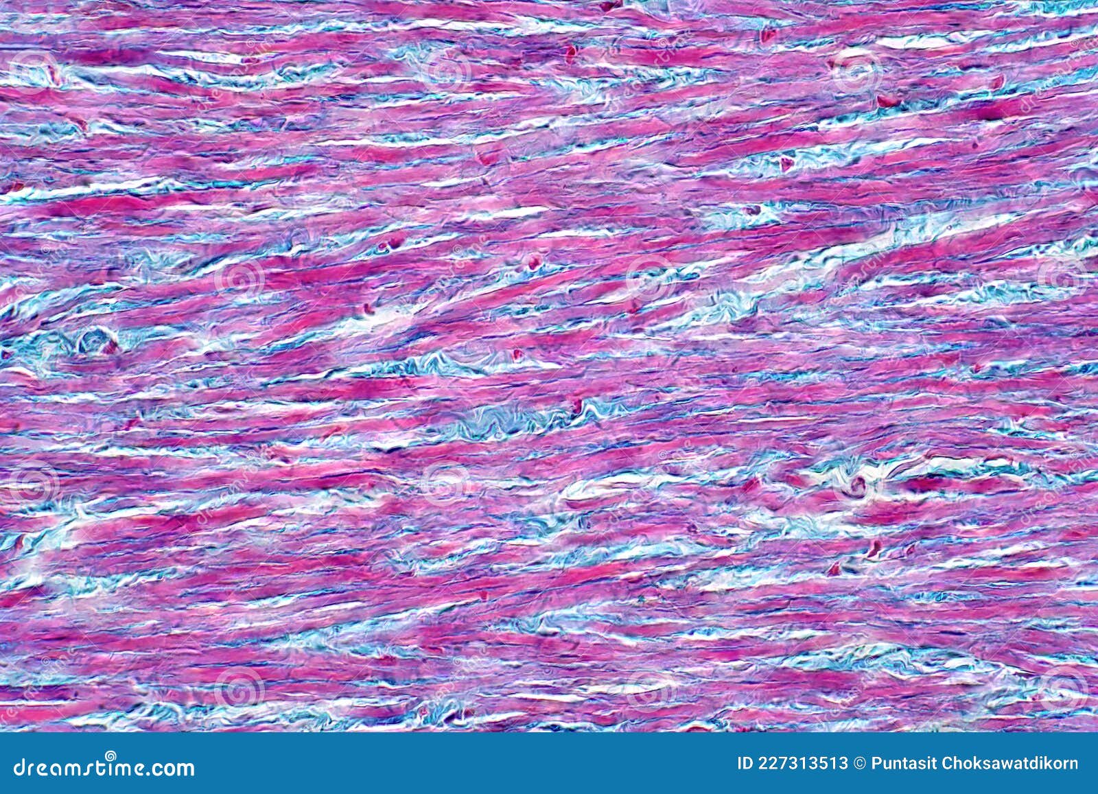 Dense Regular Connective Tissue Labeled Dense Regular Connective Tissue Labeled