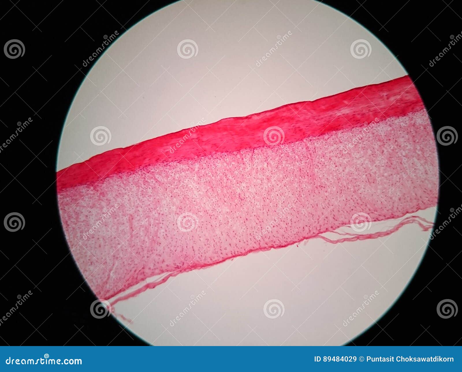 Cross section human tendon stock image. Image of body - 89484029