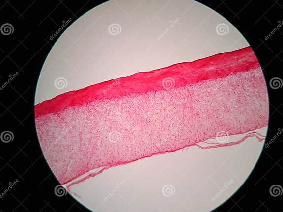 Cross section human tendon stock image. Image of body - 89484029