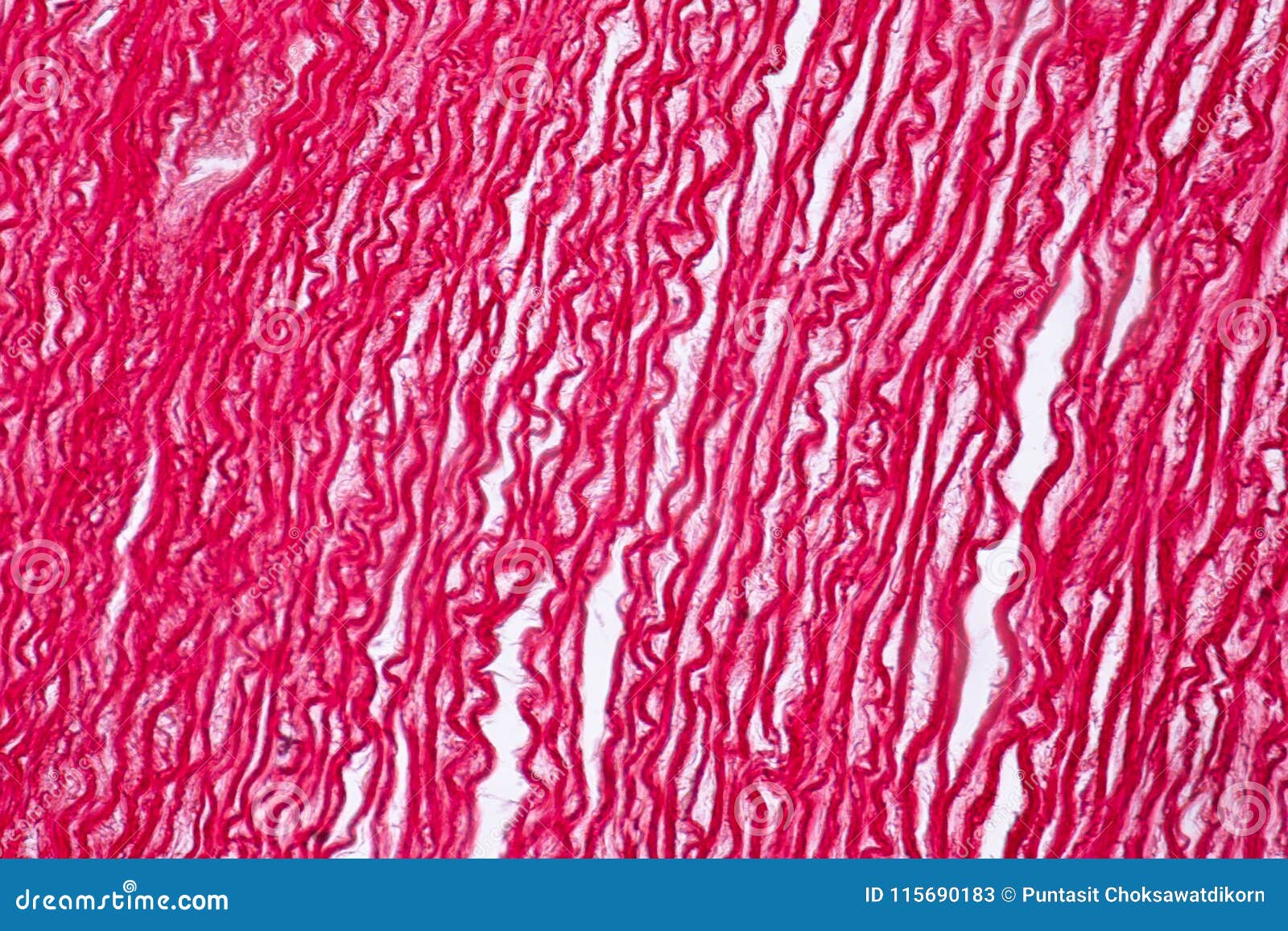 Cross Section Human Tendon Under Microscope View for Education H Stock ...