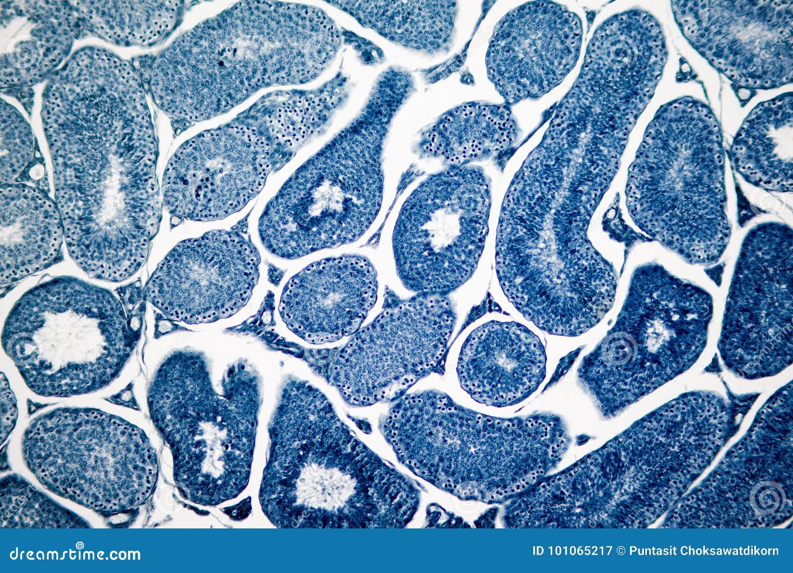 Cross Section Human Testis Under Microscope View Stock Image Image