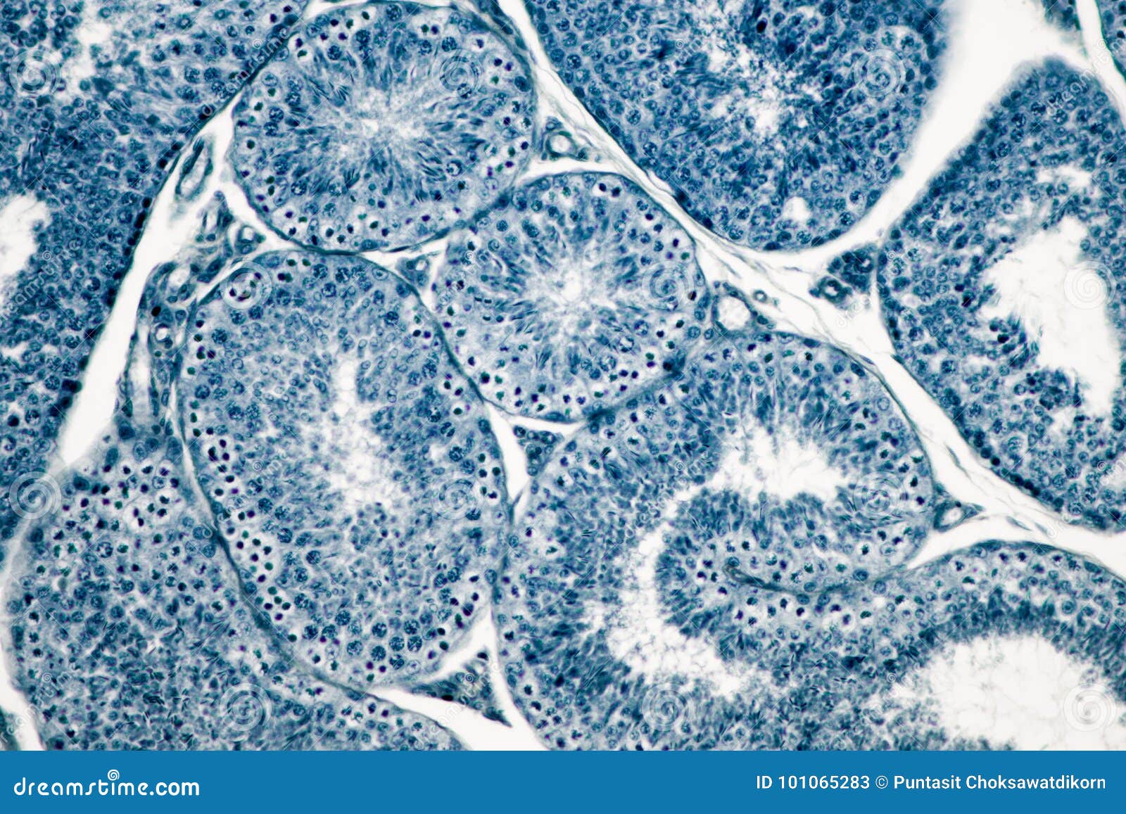 Cross Section Human Testis Under Microscope View. Stock Image - Image ...