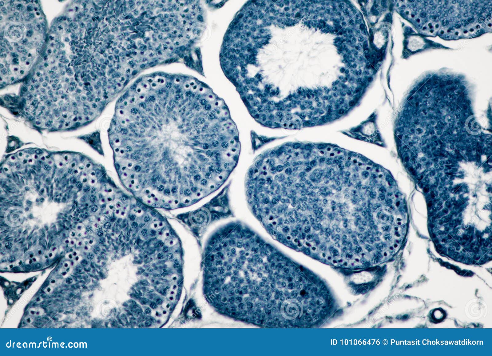 Cross Section Human Testis Under Microscope View. Stock Photo - Image ...