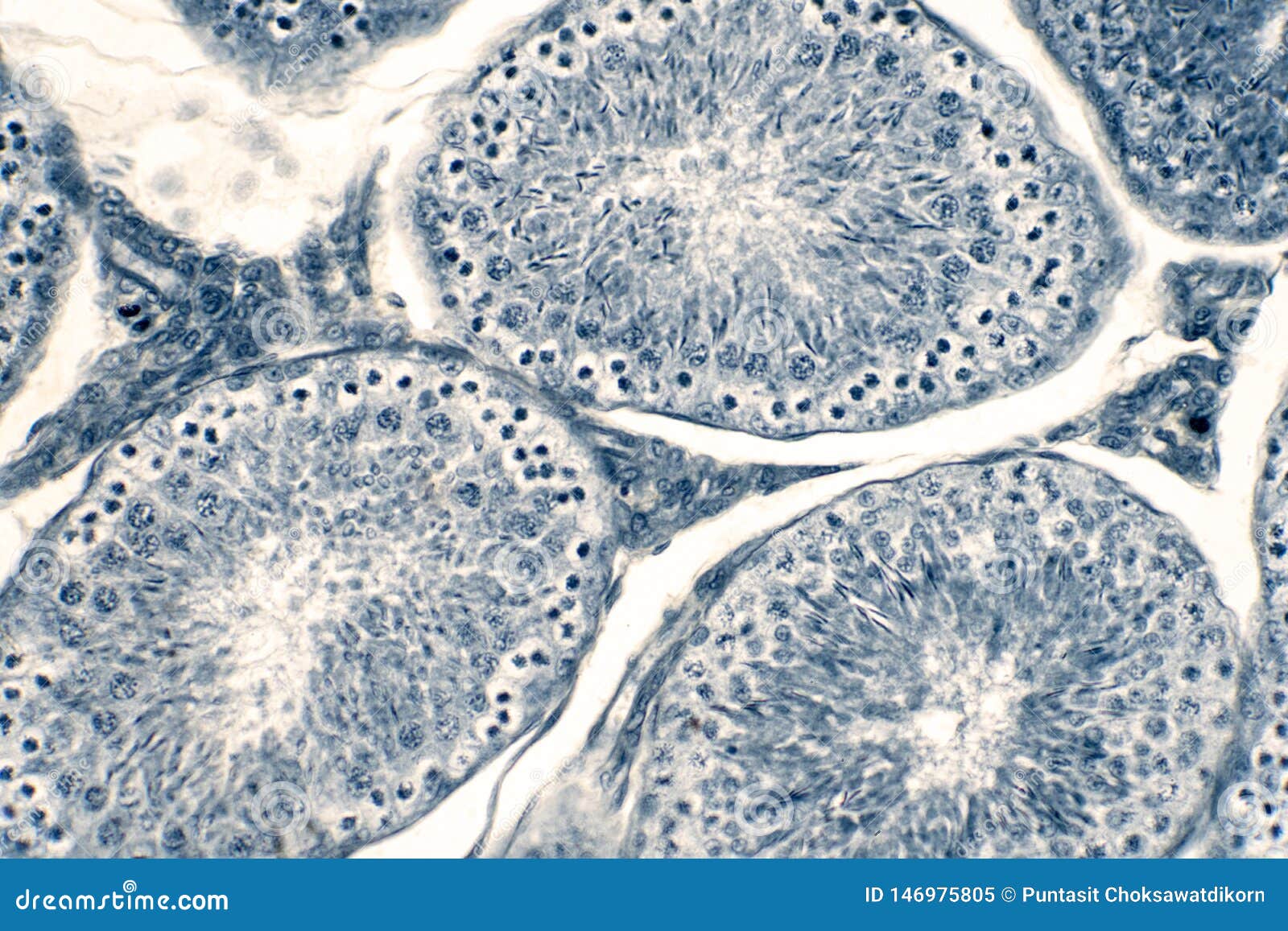 Cross Section Human Testis Under Microscope View Stock Image Image Of Cytoplasm Educational