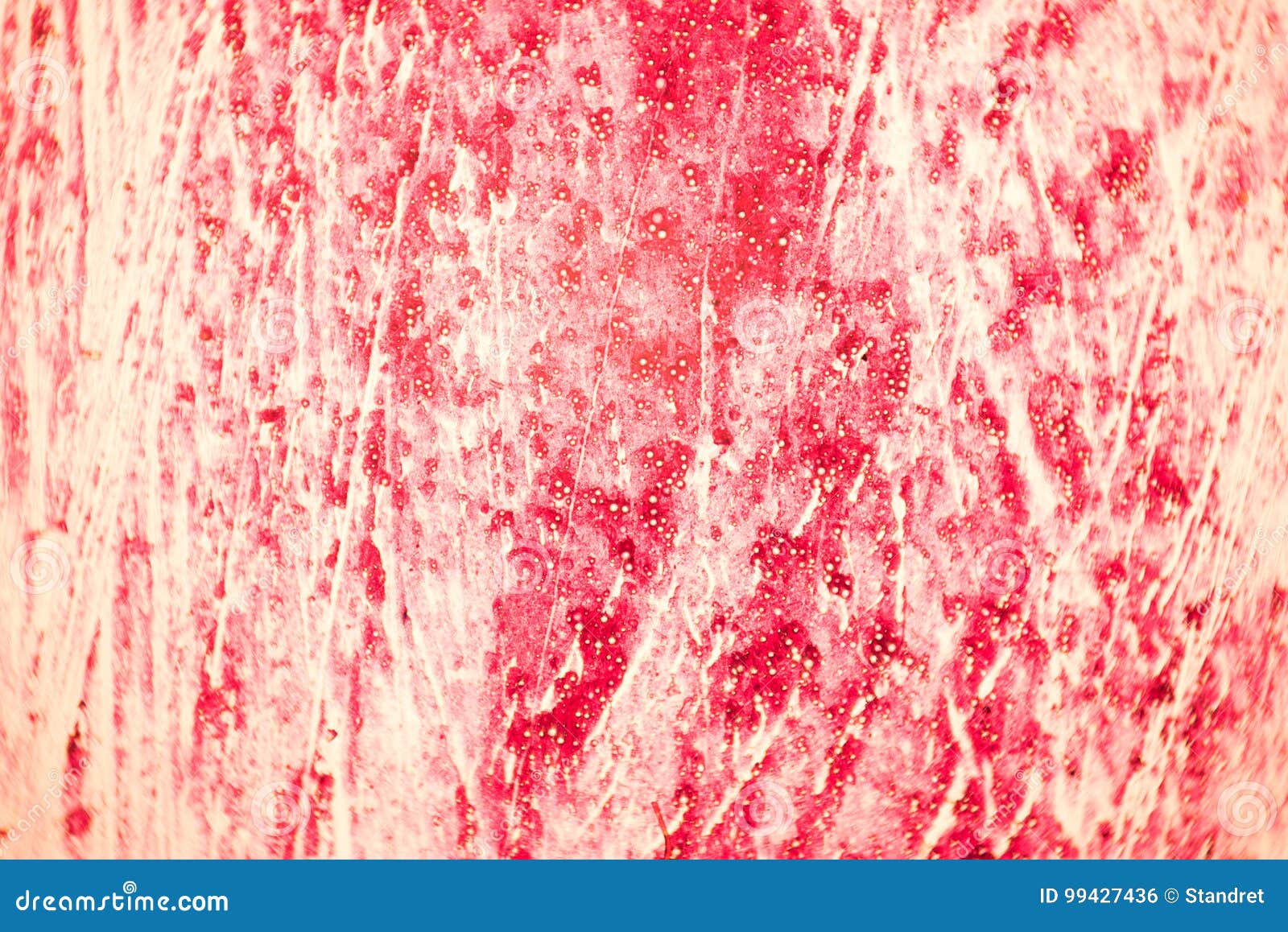 Cross Section of the Human Tissue in the Microscope View. Stock Photo ...