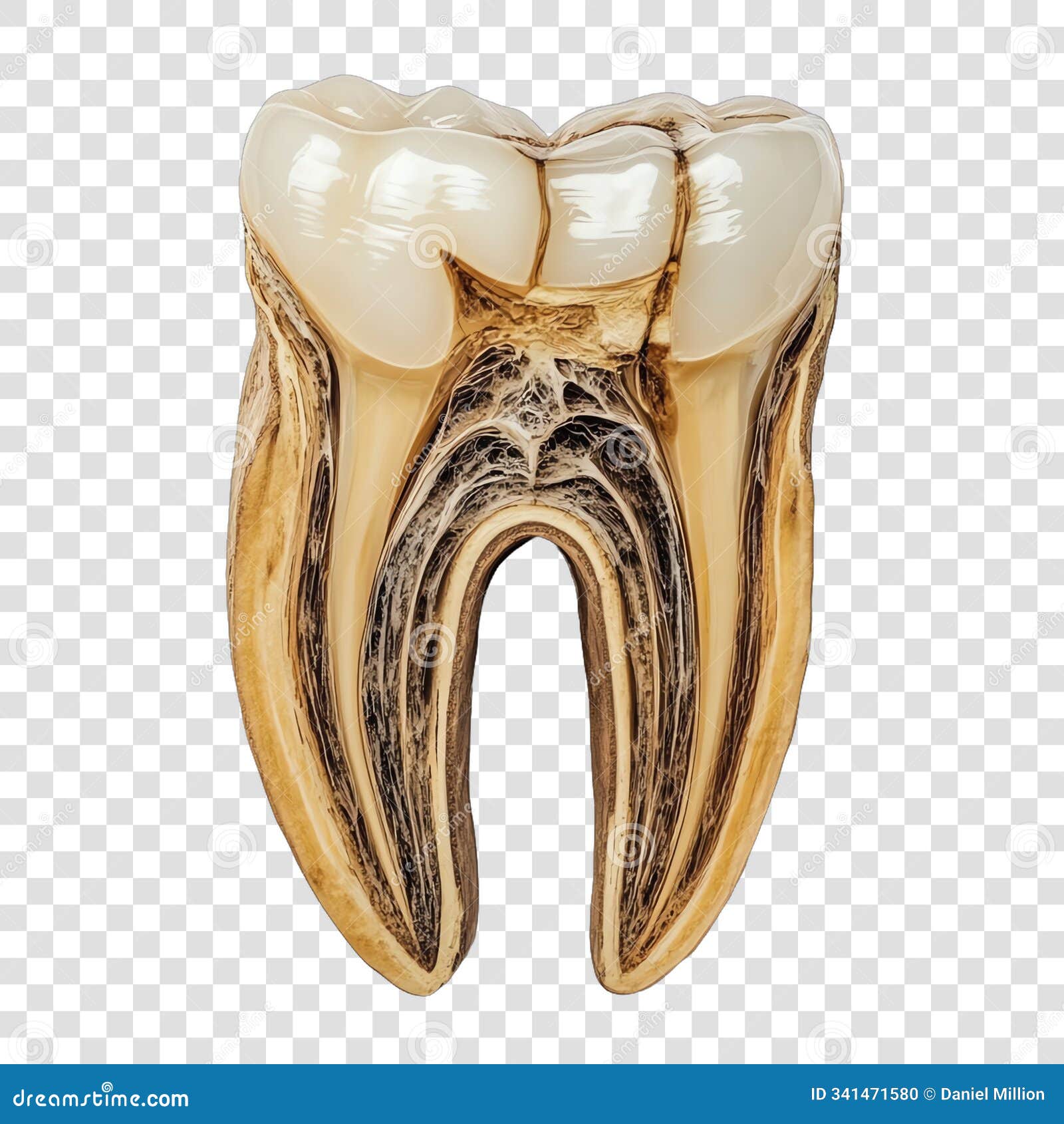 Cross Section of a Human Tooth Stock Illustration - Illustration of ...