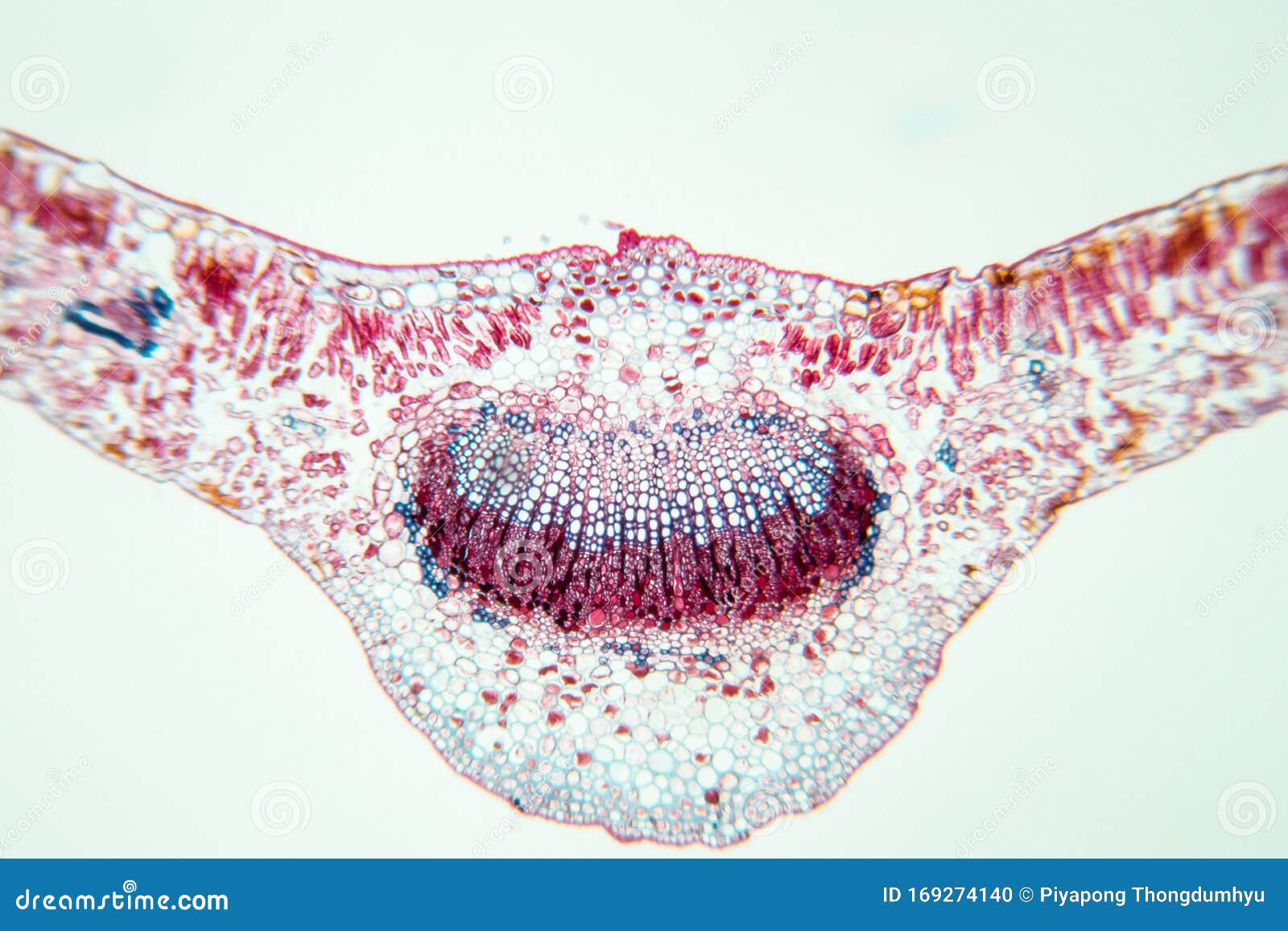 Leaf Cross Section Under Microscope Leaf Cross Section Under Microscope