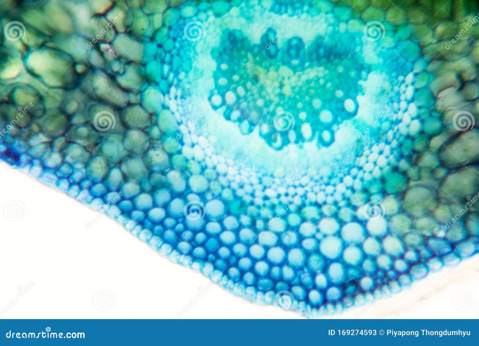 Cross-section Leaf Plant of Under the Microscope. Stock Image - Image ... Cross-section Leaf Plant of Under the Microscope. Stock Image - Image ...