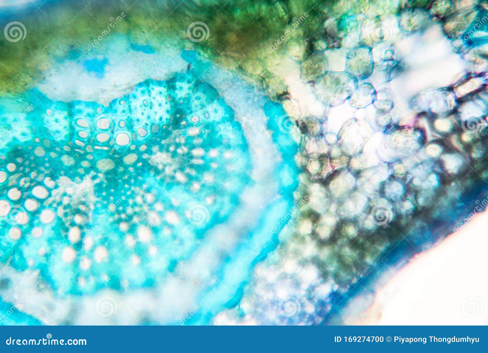 Cross-section Leaf Plant of Under the Microscope. Stock Photo - Image ...