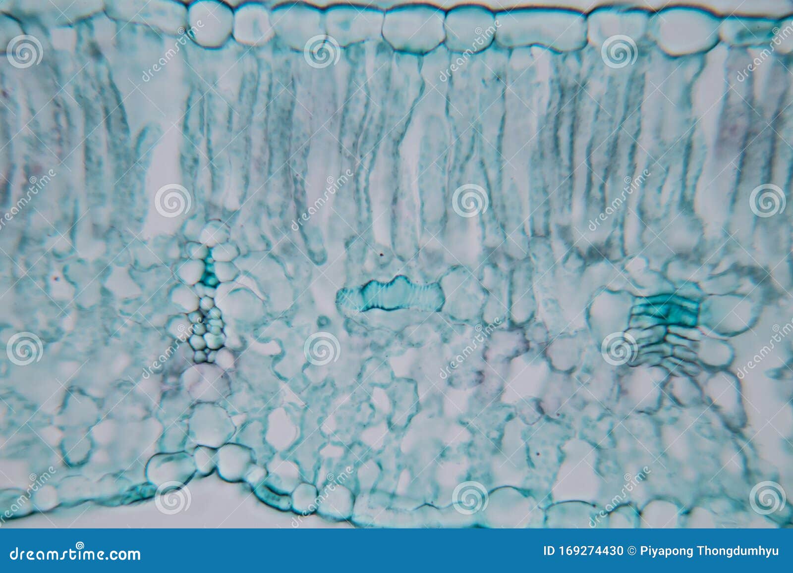 Cross-section Leaf Plant of Under the Microscope. Stock Photo - Image ...