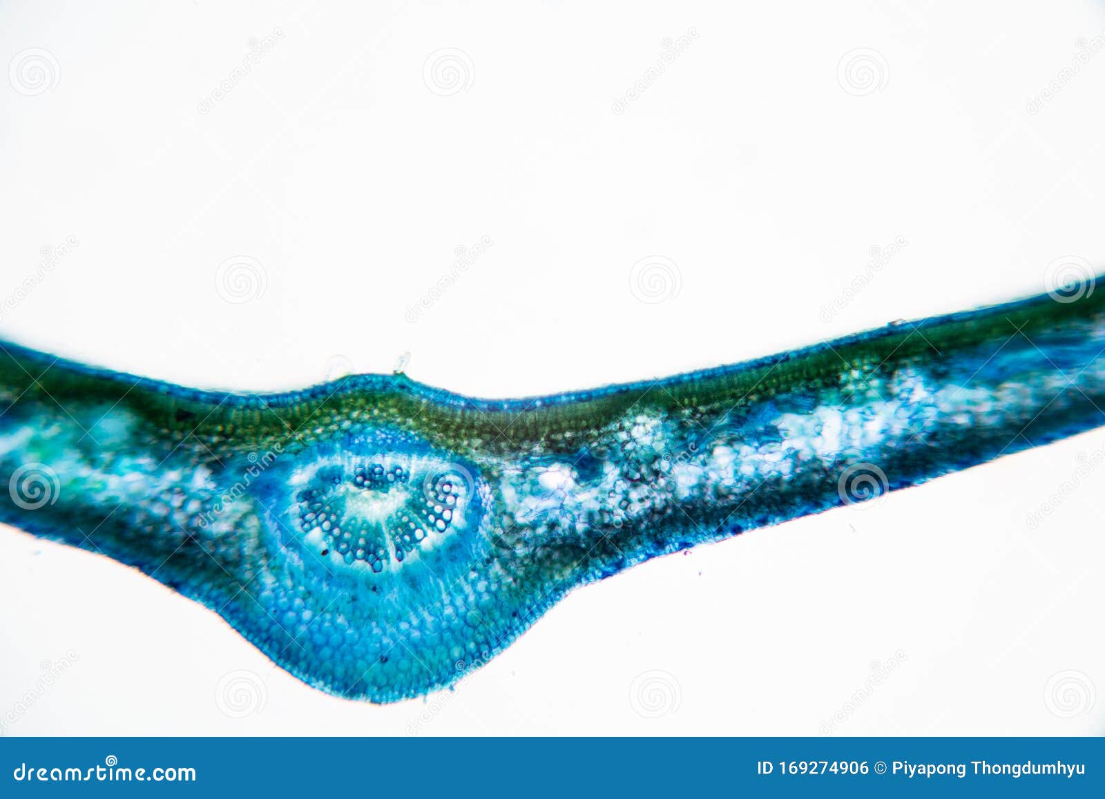 Cross-section Leaf Plant of Under the Microscope. Stock Photo - Image ...