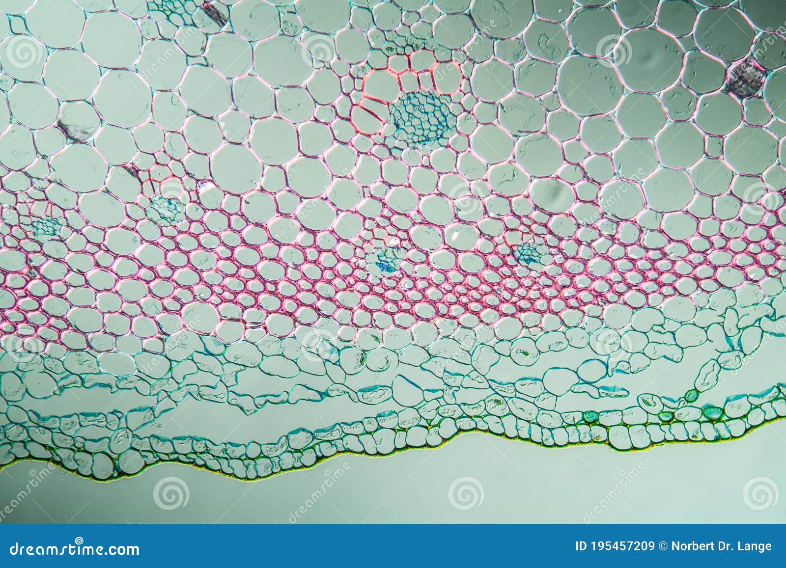 Cross Section of Lily with Stem Stock Image - Image of histology, macro ...