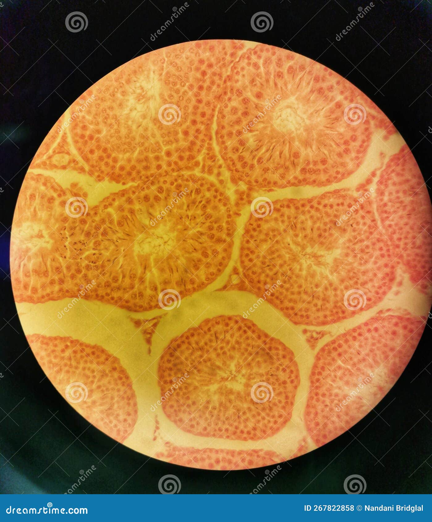 Cross Section of Male Testis Stock Photo - Image of petal, ceiling ...