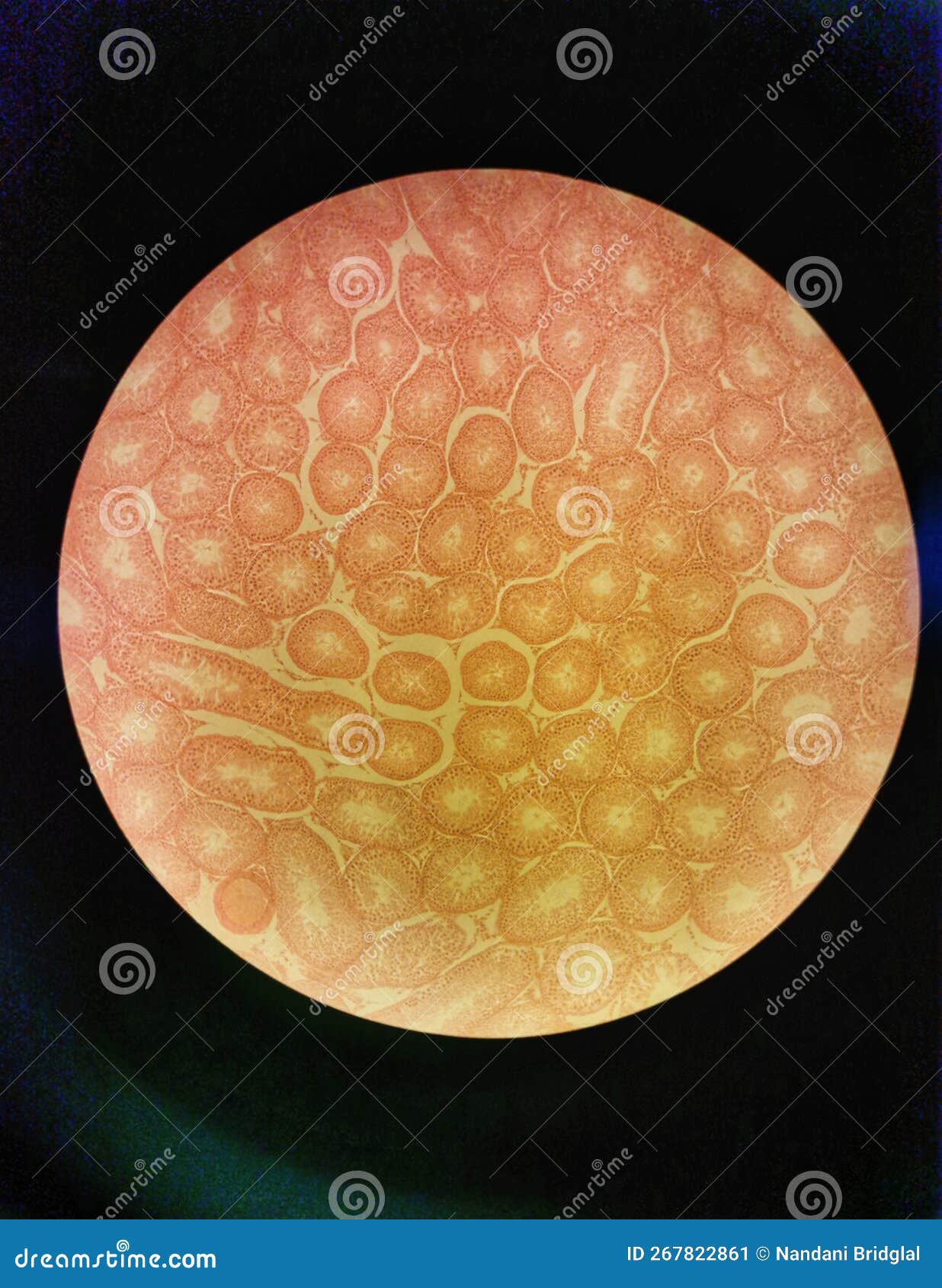 Cross Section of Male Testis Stock Image - Image of brown, yellow ...