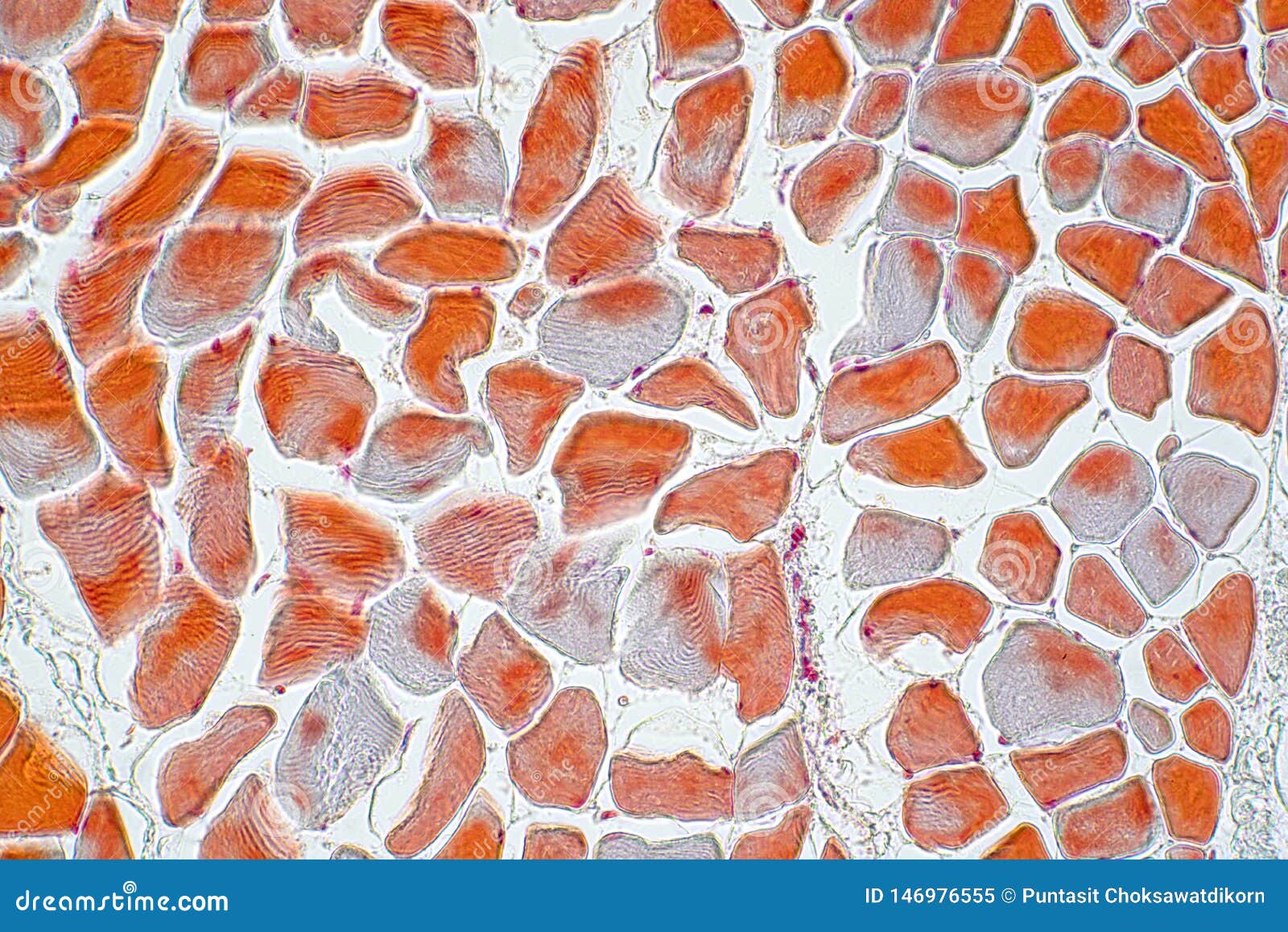 Cross Section Muscle Skeleton Micro Preparation Samples- Section Tissue ...