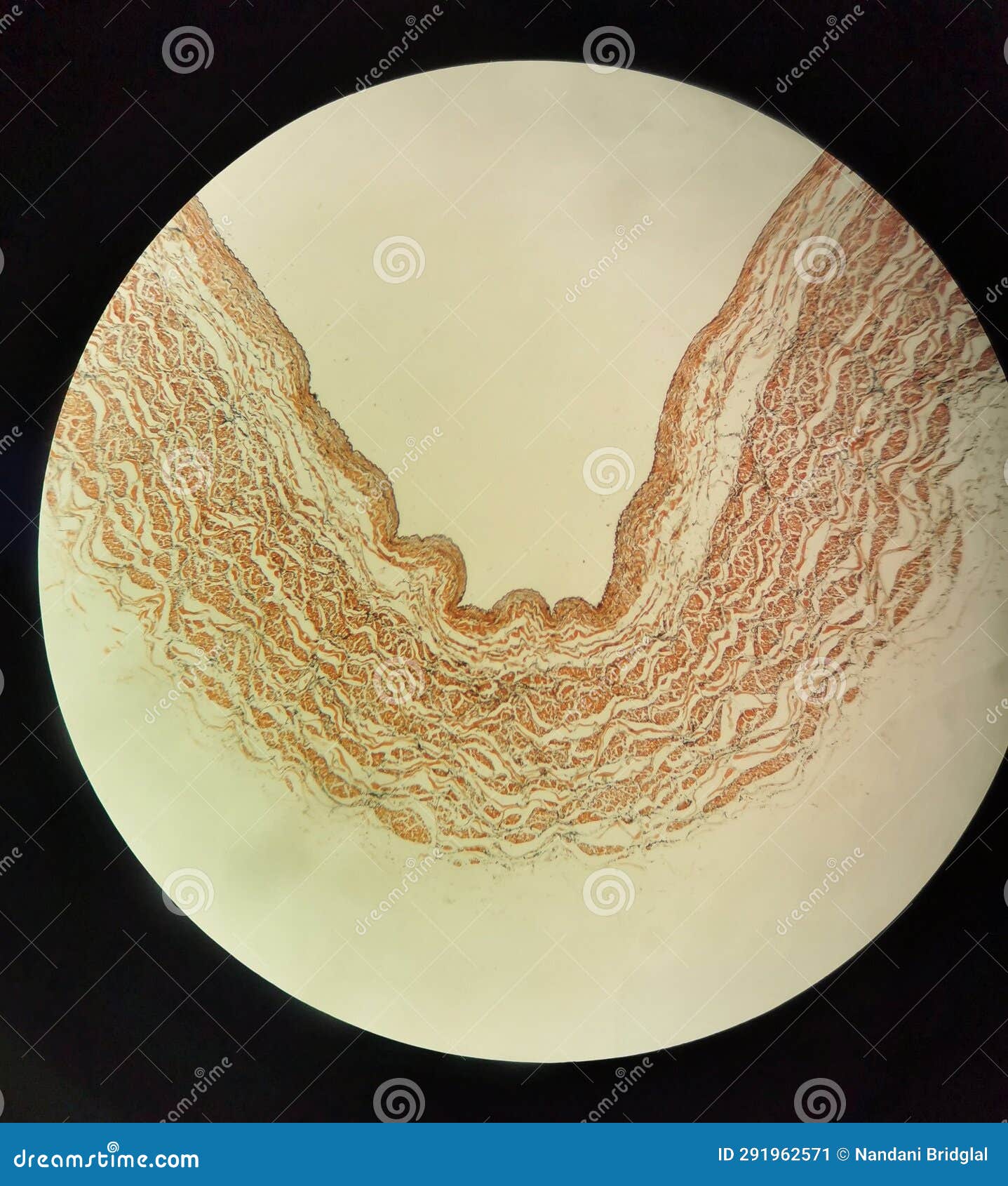 Vena Cava Cross Section Royalty-Free Stock Photo | CartoonDealer.com ...