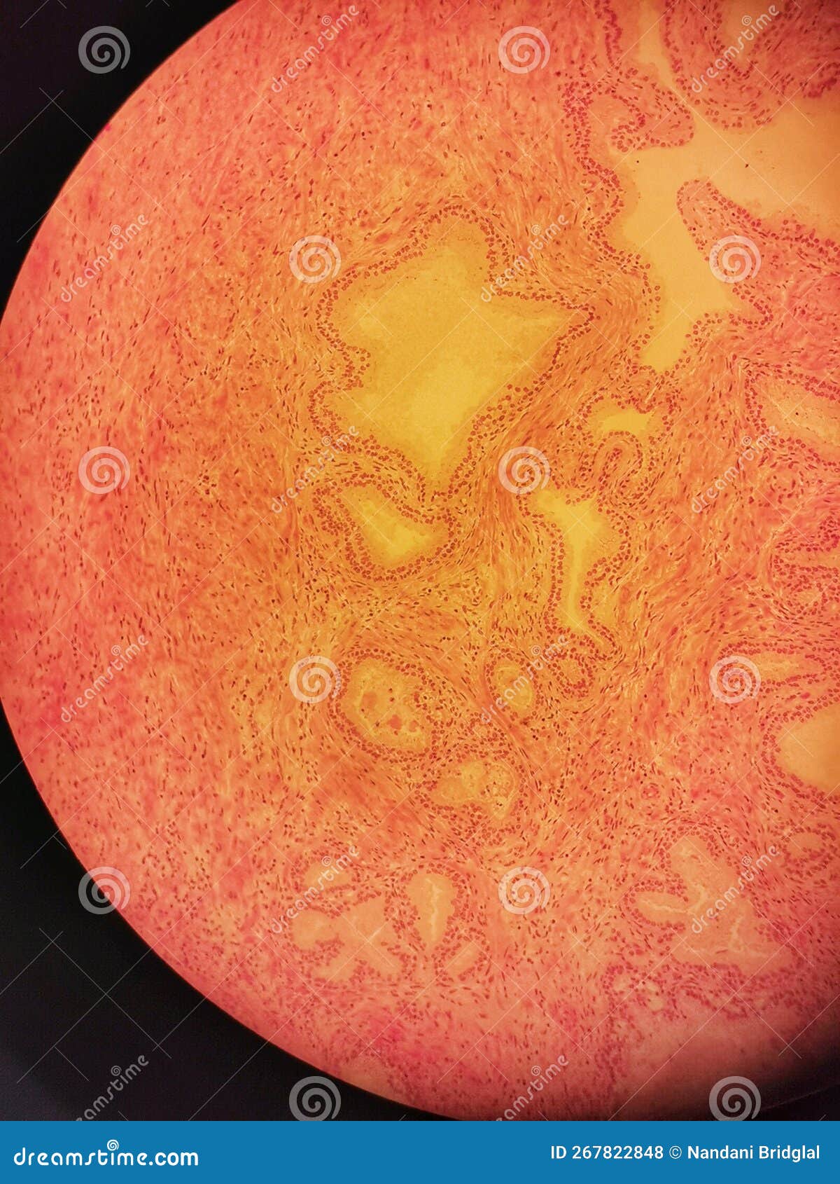 Cross-Section through a Prostate Gland Stock Photo - Image of medical ...