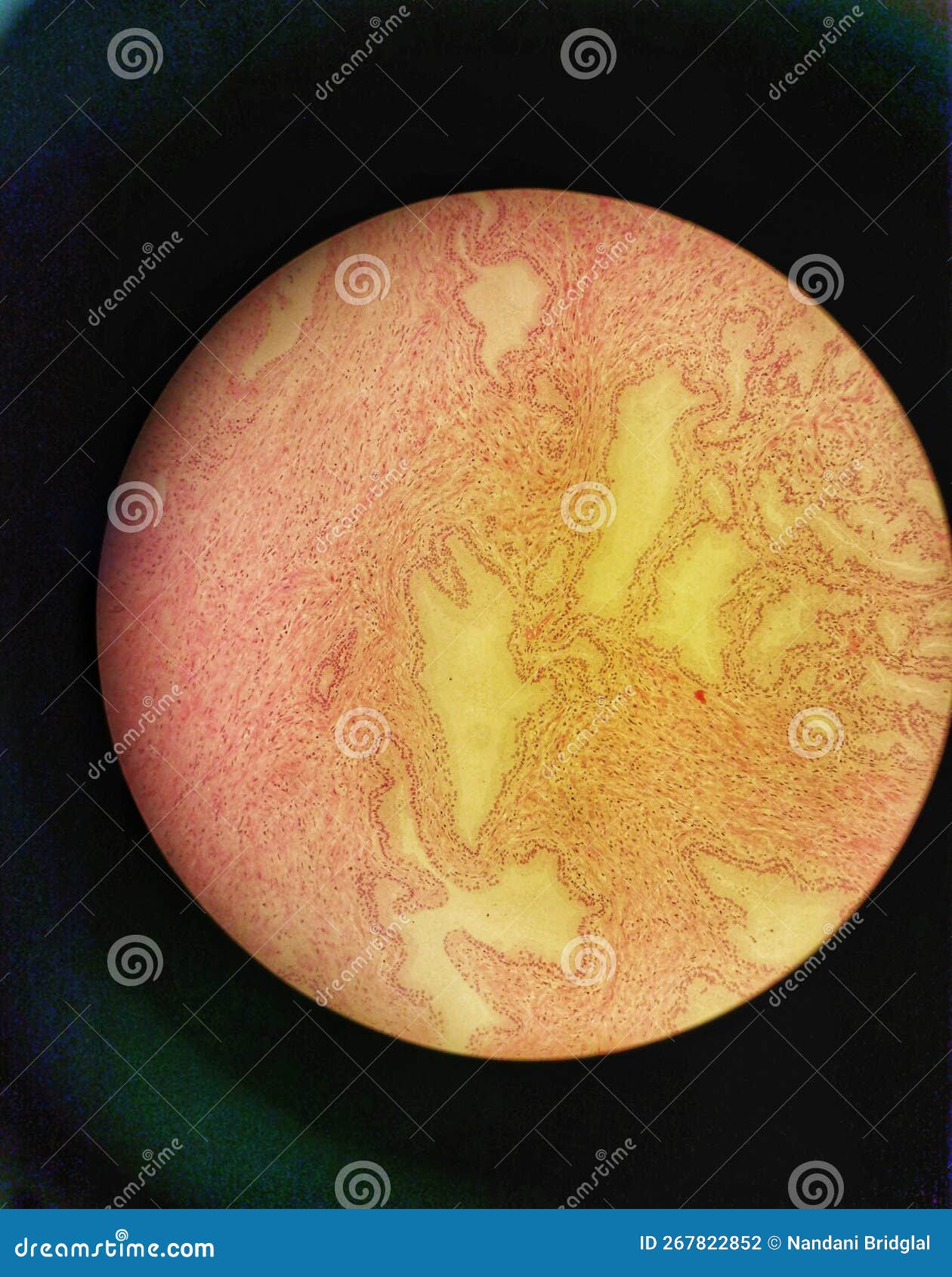 Cross-Section through a Prostate Gland Stock Photo - Image of internal ...