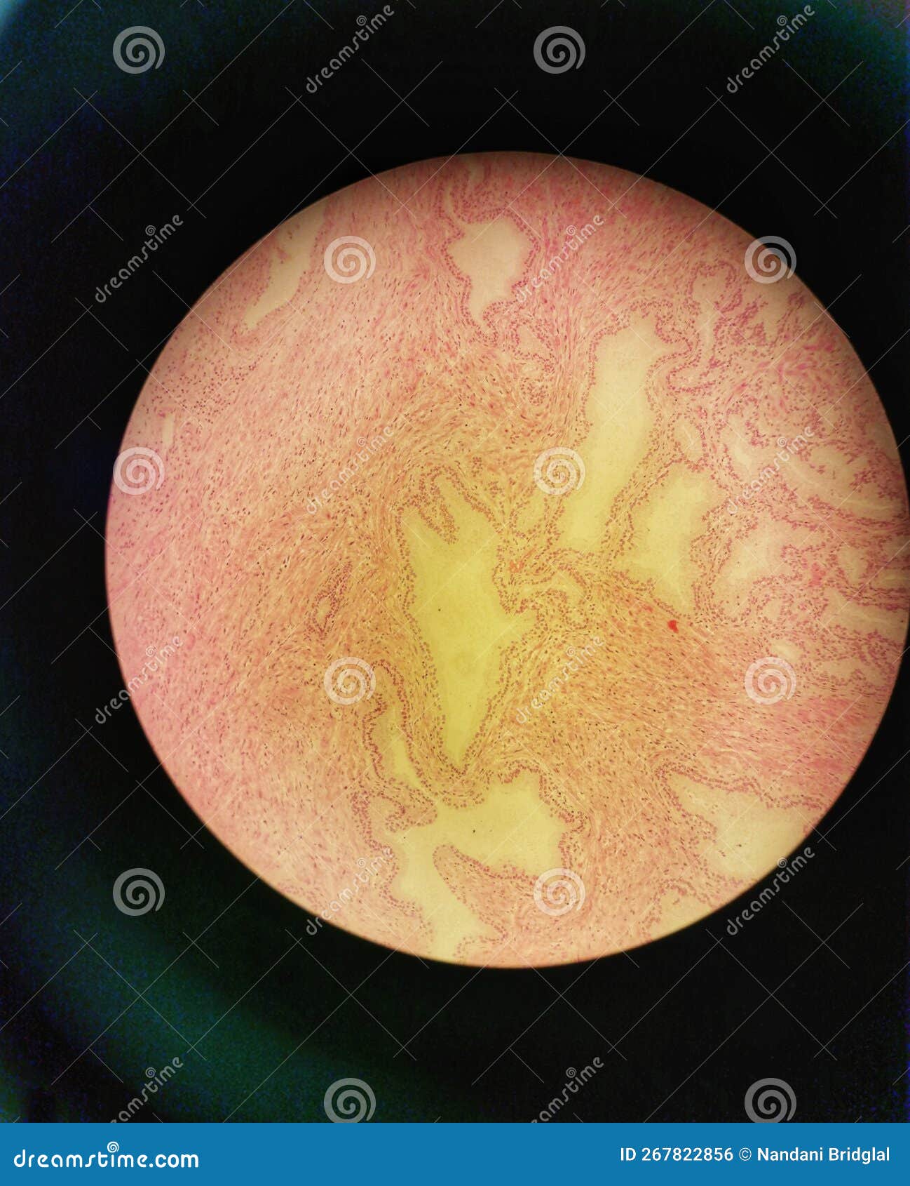 Cross-Section through a Prostate Gland Stock Photo - Image of males ...