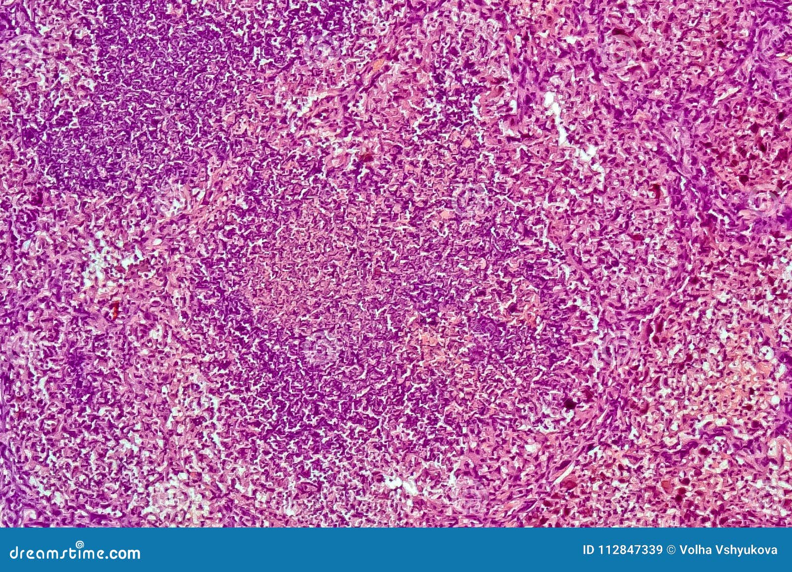 Cross-section of Rat Normal Lung Tissue, 40x Zoom Stock Image - Image ... Cross-section of Rat Normal Lung Tissue, 40x Zoom Stock Image - Image ...