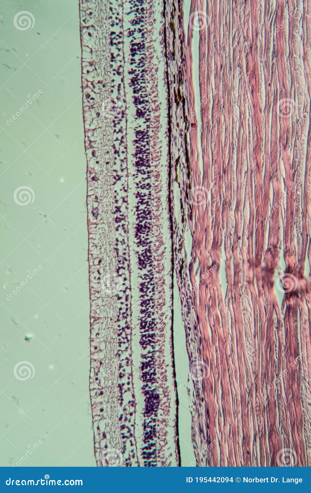 Cross-section through the Retina Stock Photo - Image of histology ...