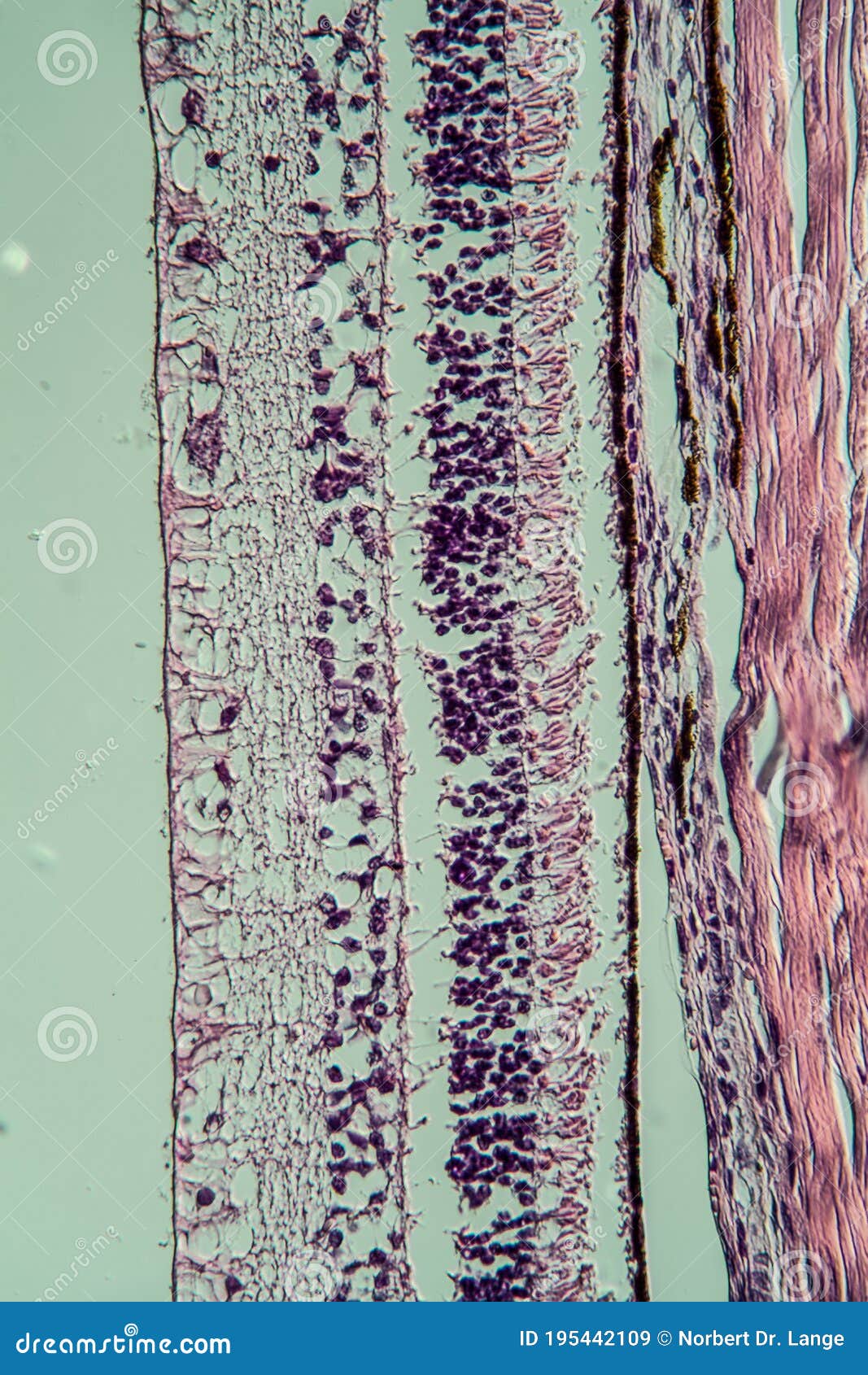 Cross-section through the Retina Stock Image - Image of retina, macro ...
