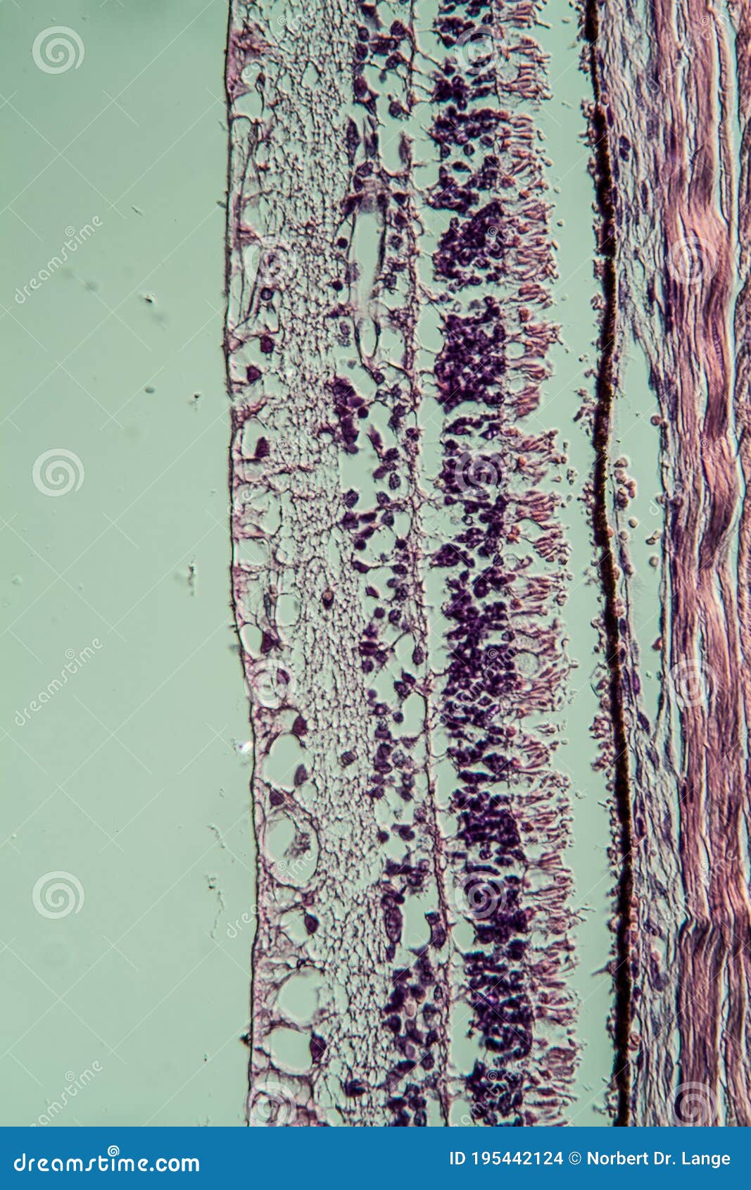 Cross-section through the Retina Stock Photo - Image of macro, tissue ...