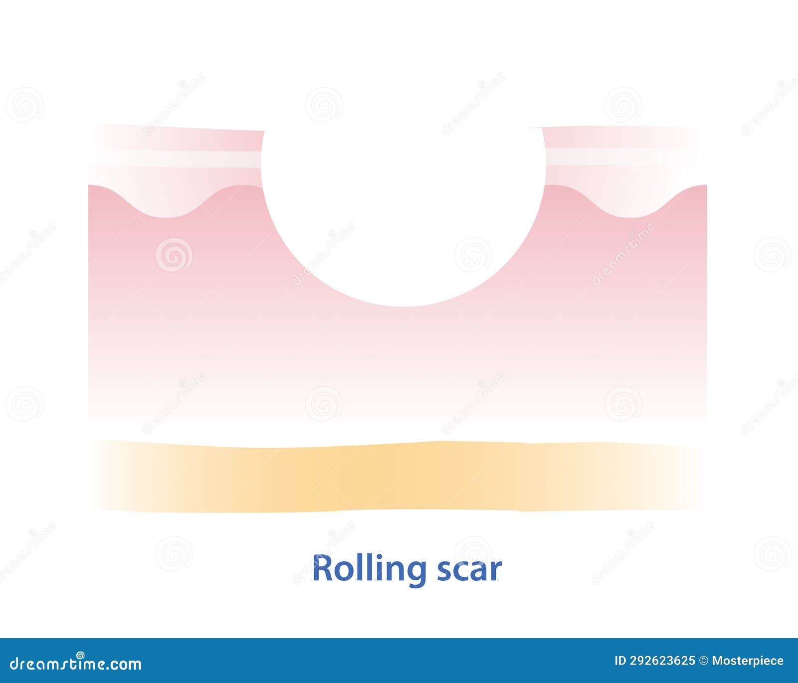 Cross Section Of Rolling Scar Vector Illustration Isolated On White ...