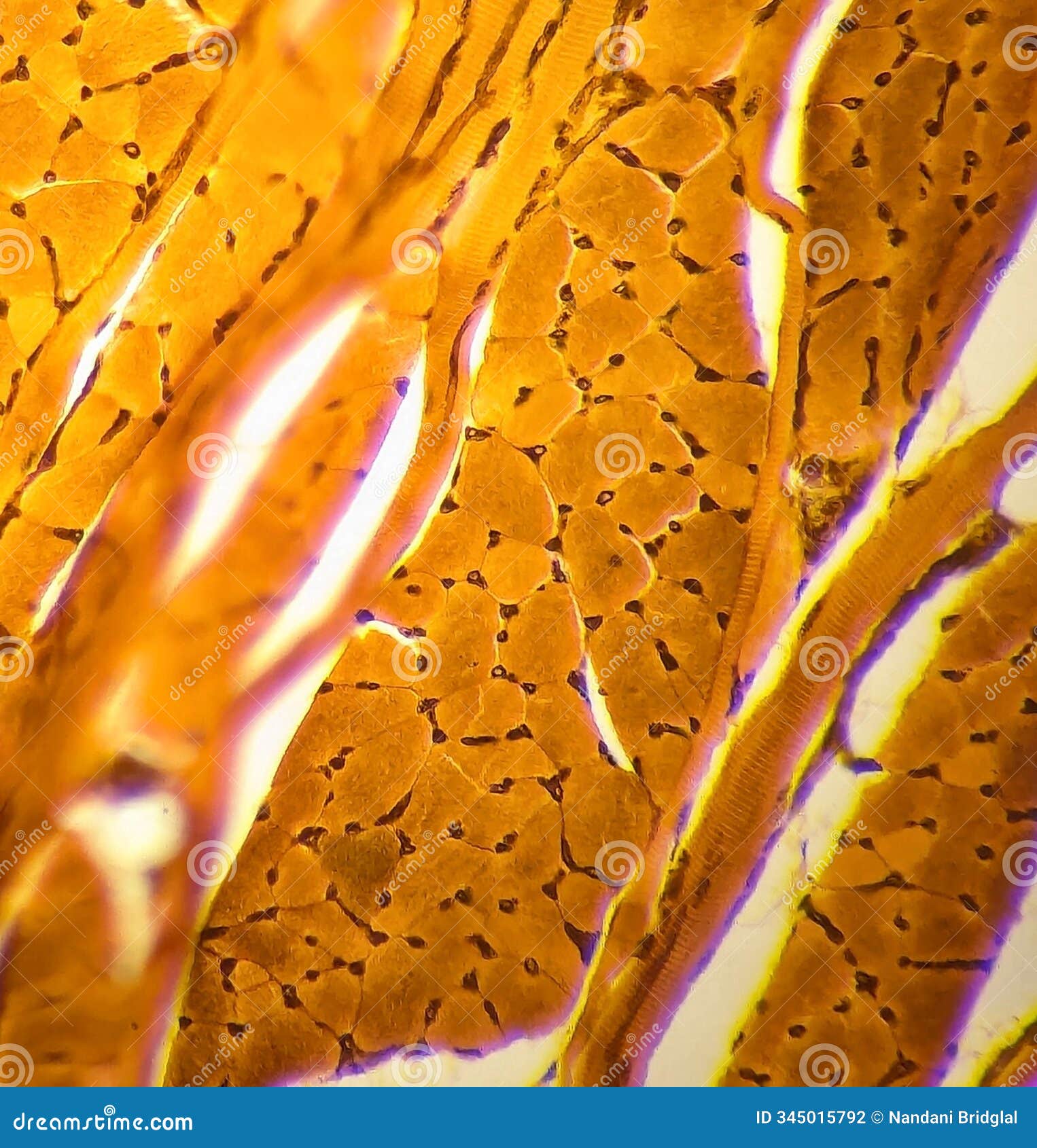 Cross-Section of a Skeletal Muscle Tissue Stock Photo - Image of ...