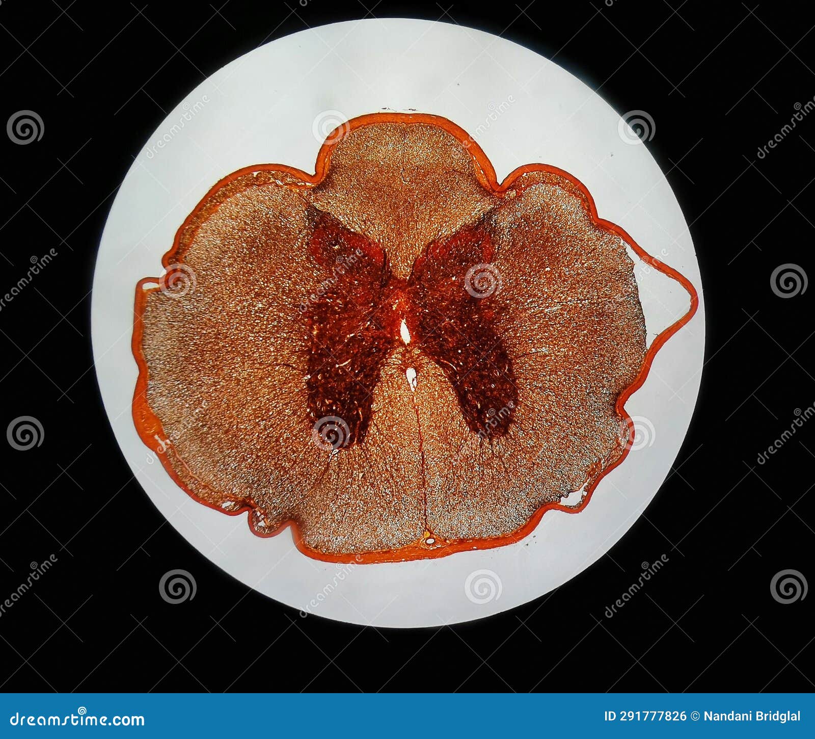 Cross-Section of a Spinal Cord Stock Photo - Image of circle, spinal ...