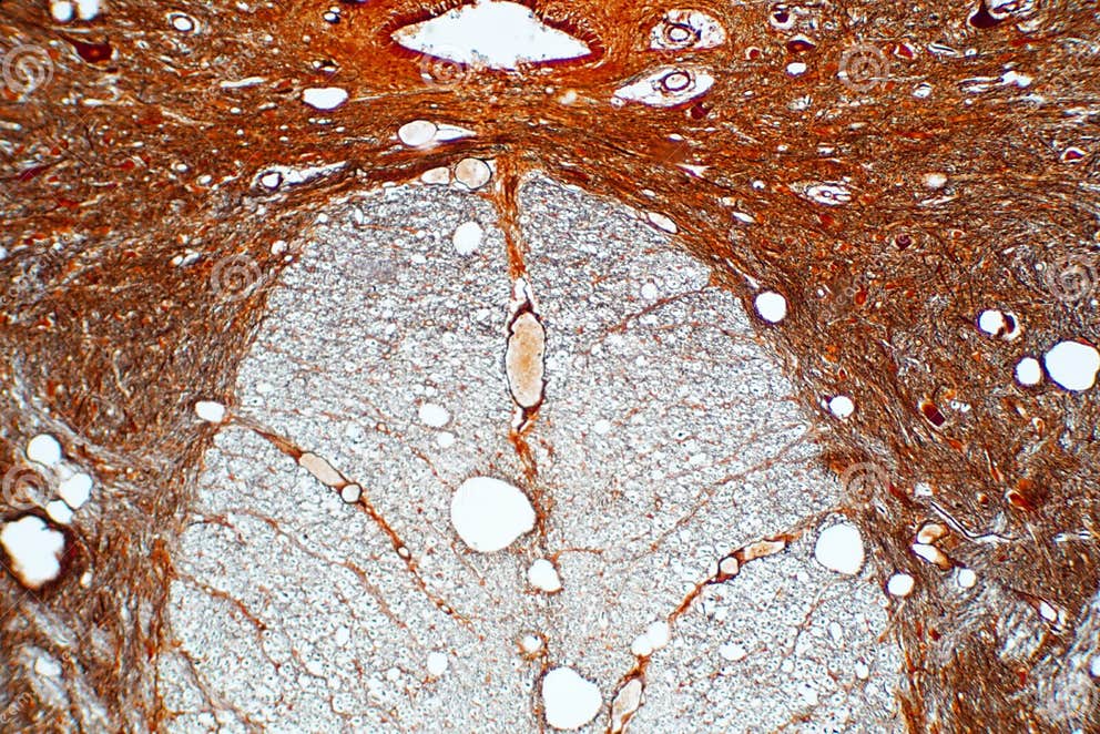 Cross Section of Spinal Cord Under the Microscope View. Stock Photo ...