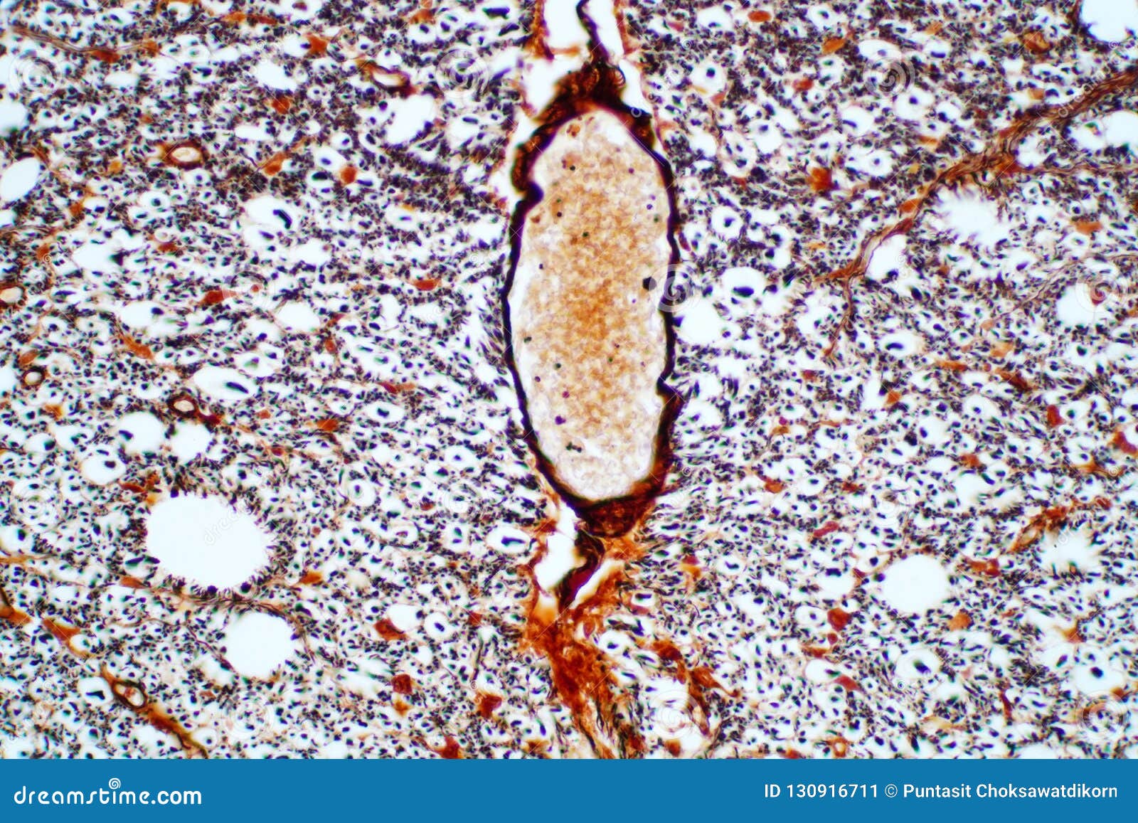 Cross Section of Spinal Cord Under the Microscope View. Stock Image ...