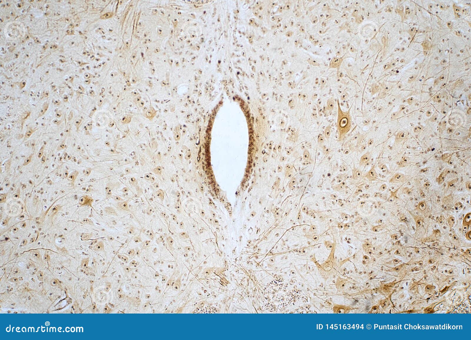 Cross Section of Spinal Cord Under the Microscope View Stock Photo ...