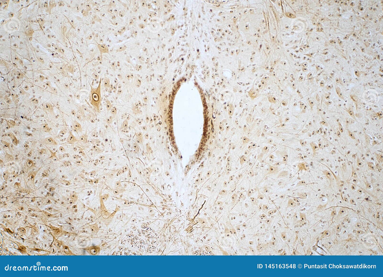 Cross Section of Spinal Cord Under the Microscope View Stock Photo ...