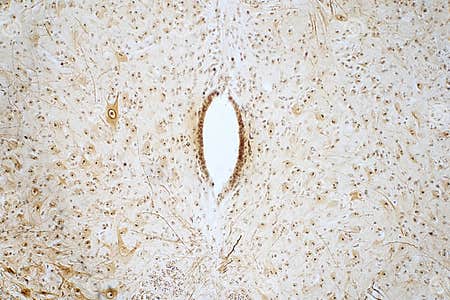 Cross Section of Spinal Cord Under the Microscope View Stock Photo ...